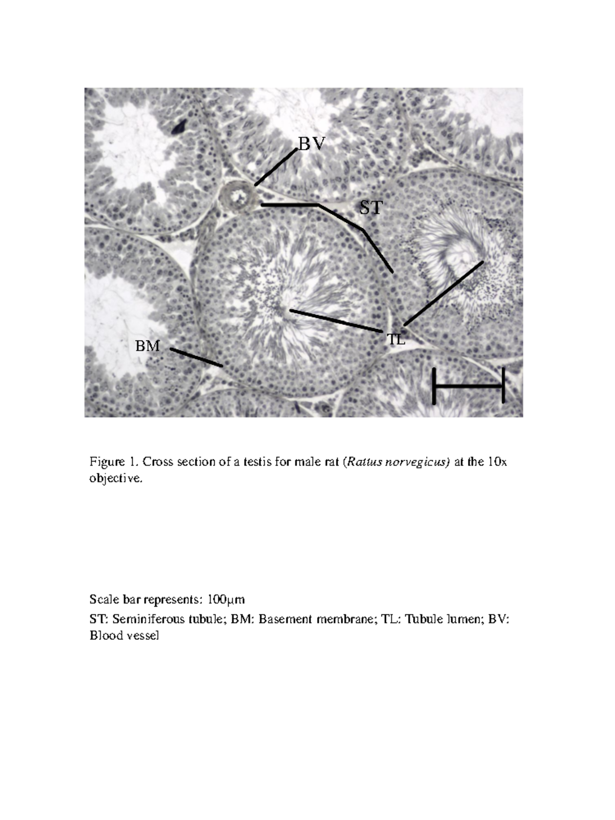 BIO 1140 Rat testies - BIO1140 - Figure 1. Cross section of a testis ...