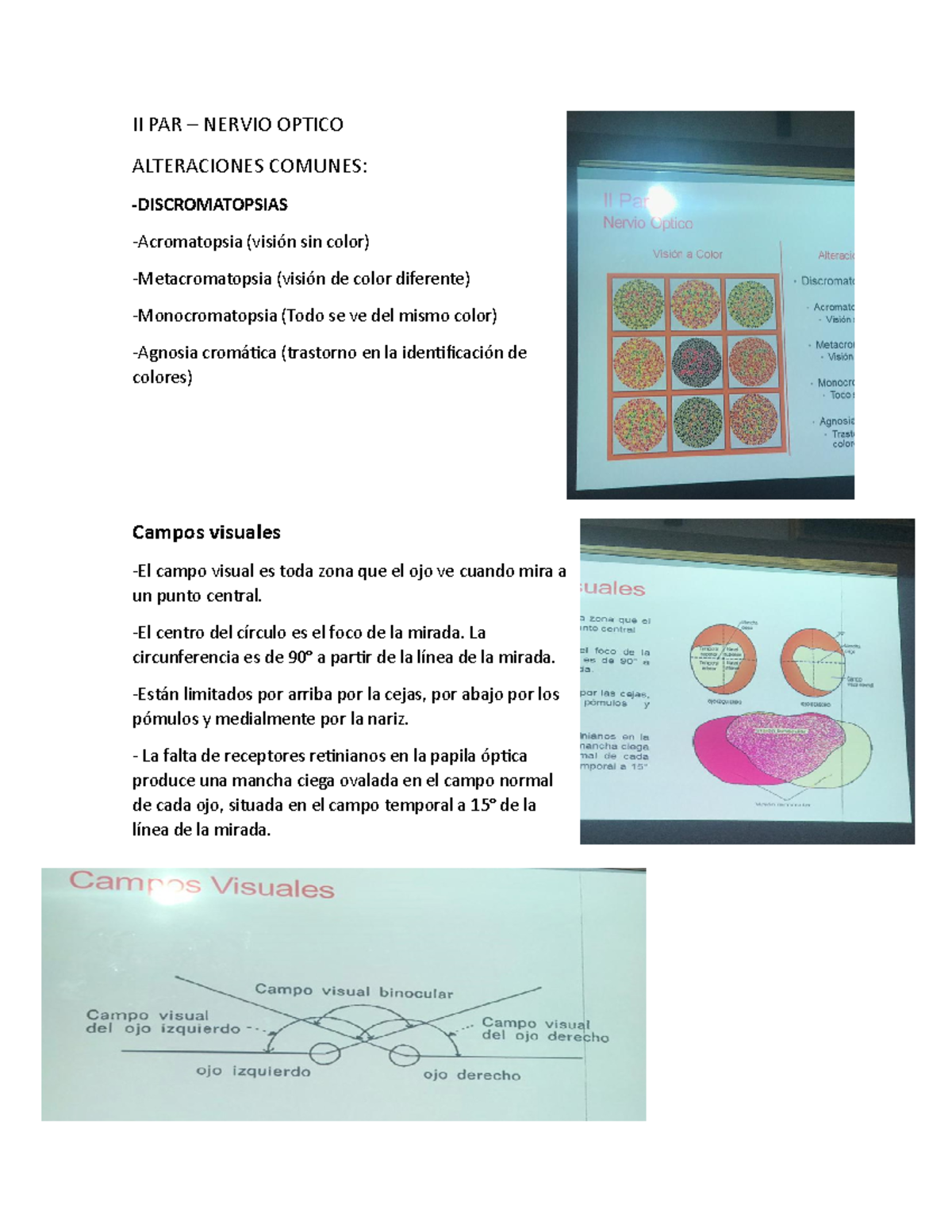 Nervio Óptico: Resumen de Alteraciones Visuales y Diagnóstico - Studocu