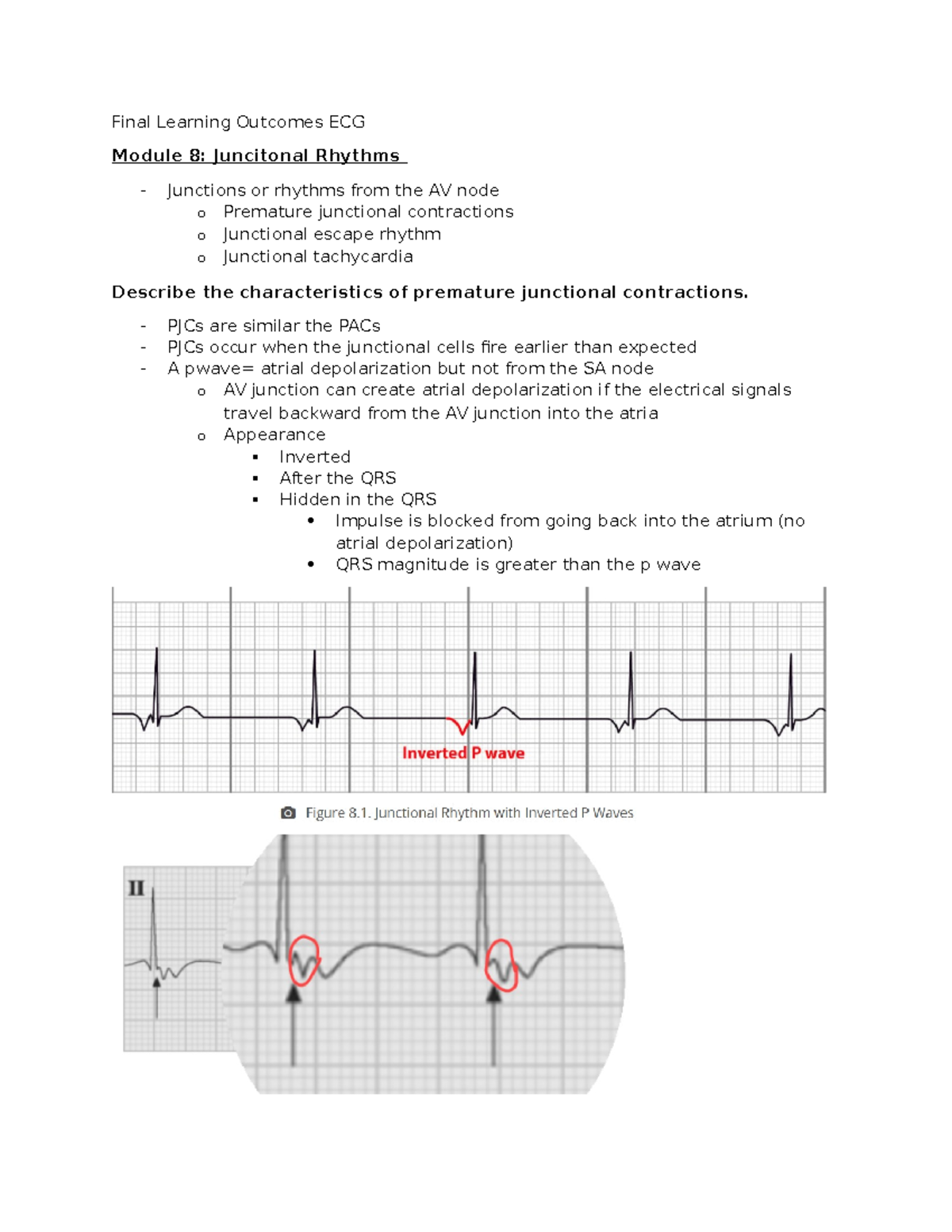 Final Learning Outcomes ECG Module 8: Junctional Rhythms & Dysrhythmias ...
