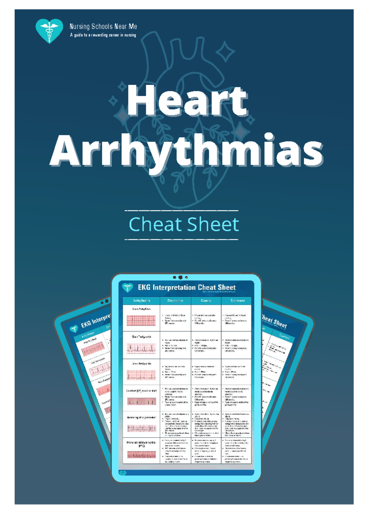 EKG Interpretation Cheat Sheet: Key Steps & Arrhythmia Guide - Studocu