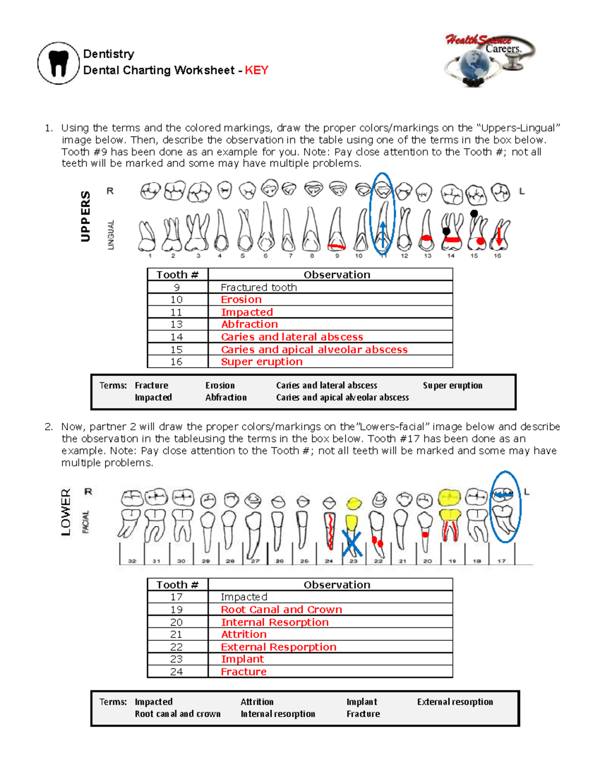 Dentistry Dental Charting Worksheet KEY UPPERS Activity 2 Part 2 - Studocu