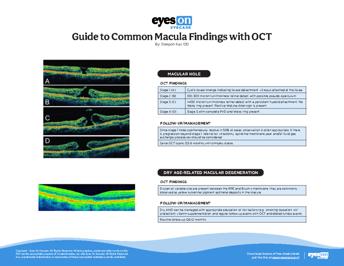 Guide to Common Macula Findings with OCT Cheat-Sheet - Stage 1 (A ...