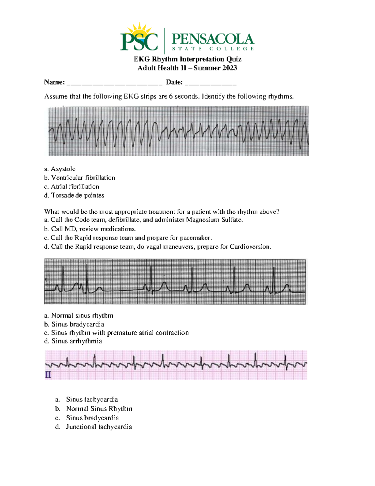 EKG Rhythm Interpretation Quiz - Identify the following rhythms. a ...
