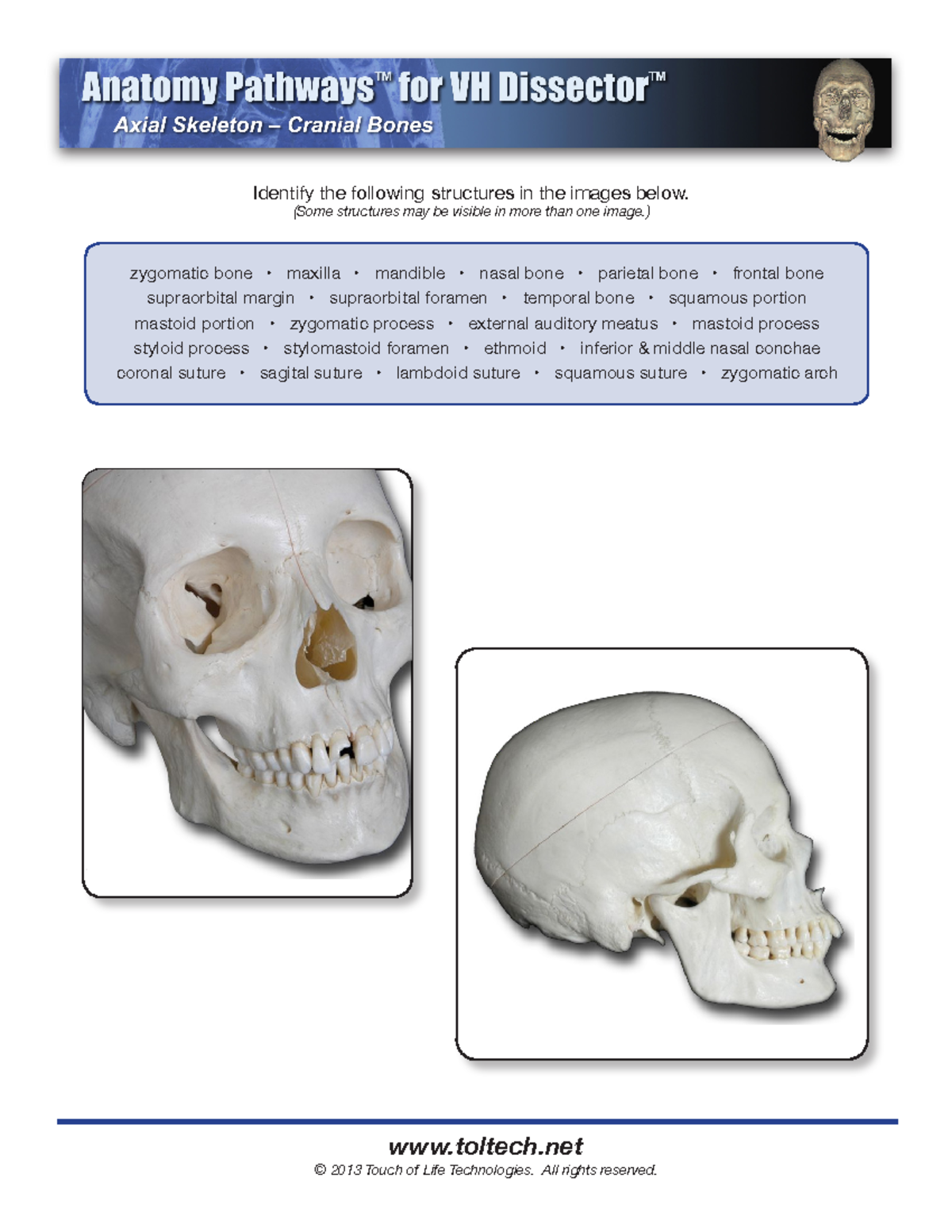 Skull label - toltech © 2013 Touch of Life Technologies. All rights ...