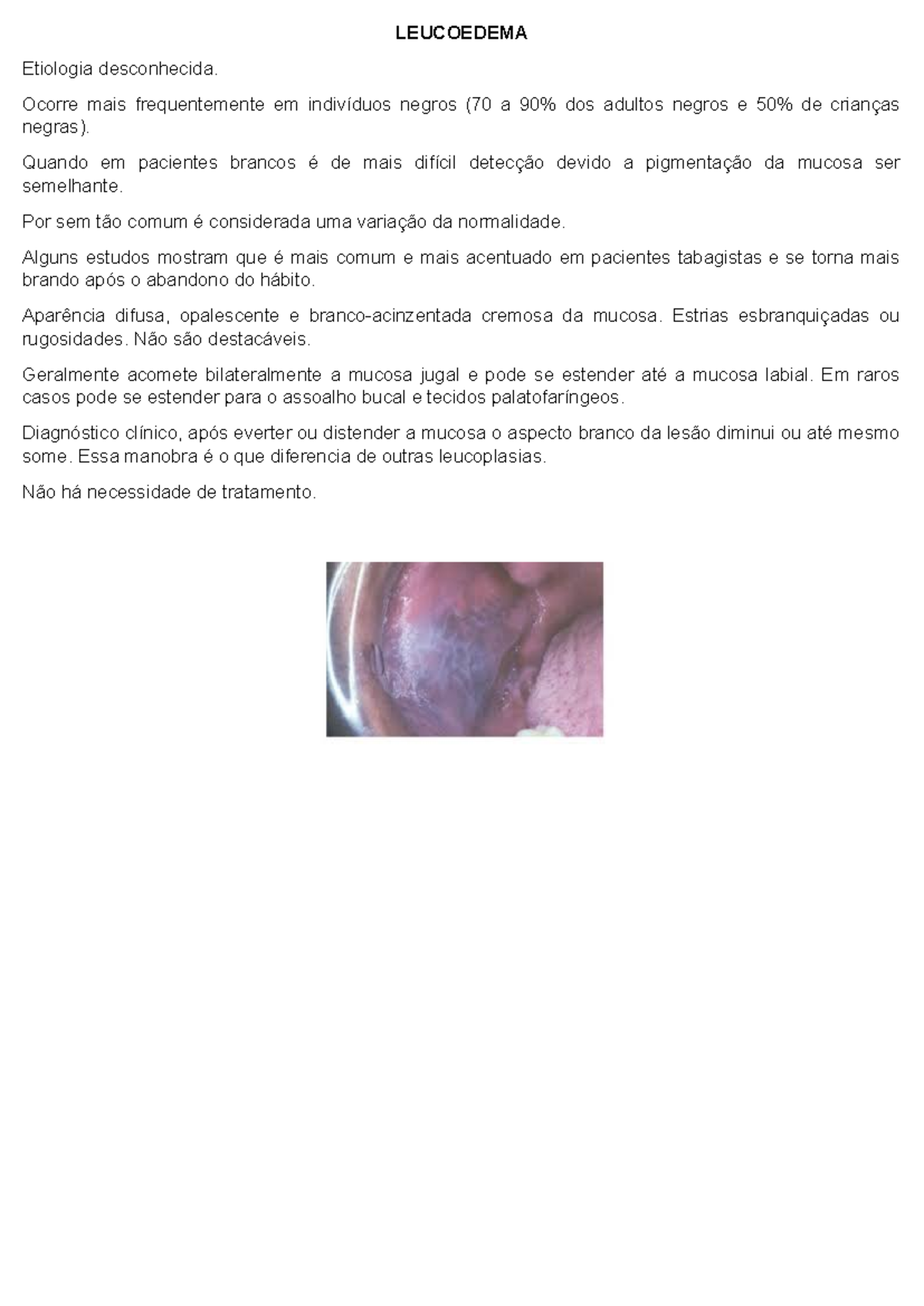 Leucoedema: Etiologia e Diagnóstico Clínico - Studocu