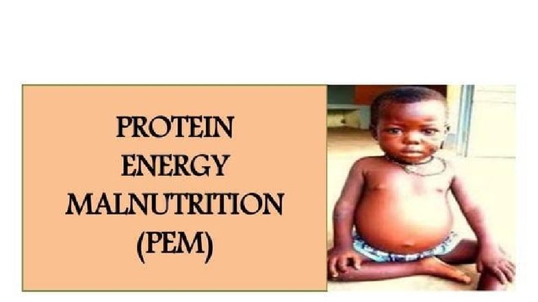 PEM (Protein Energy Malnutrition) Overview and Classification - Studocu