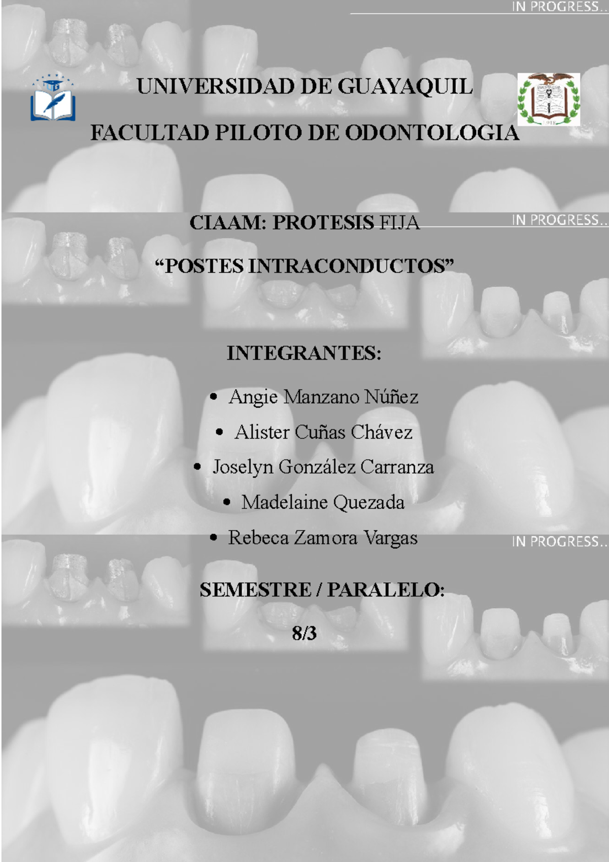 Postes Intrarradiculares en Endodoncia: Uso y Tipos - Protes. Fija 8 ...