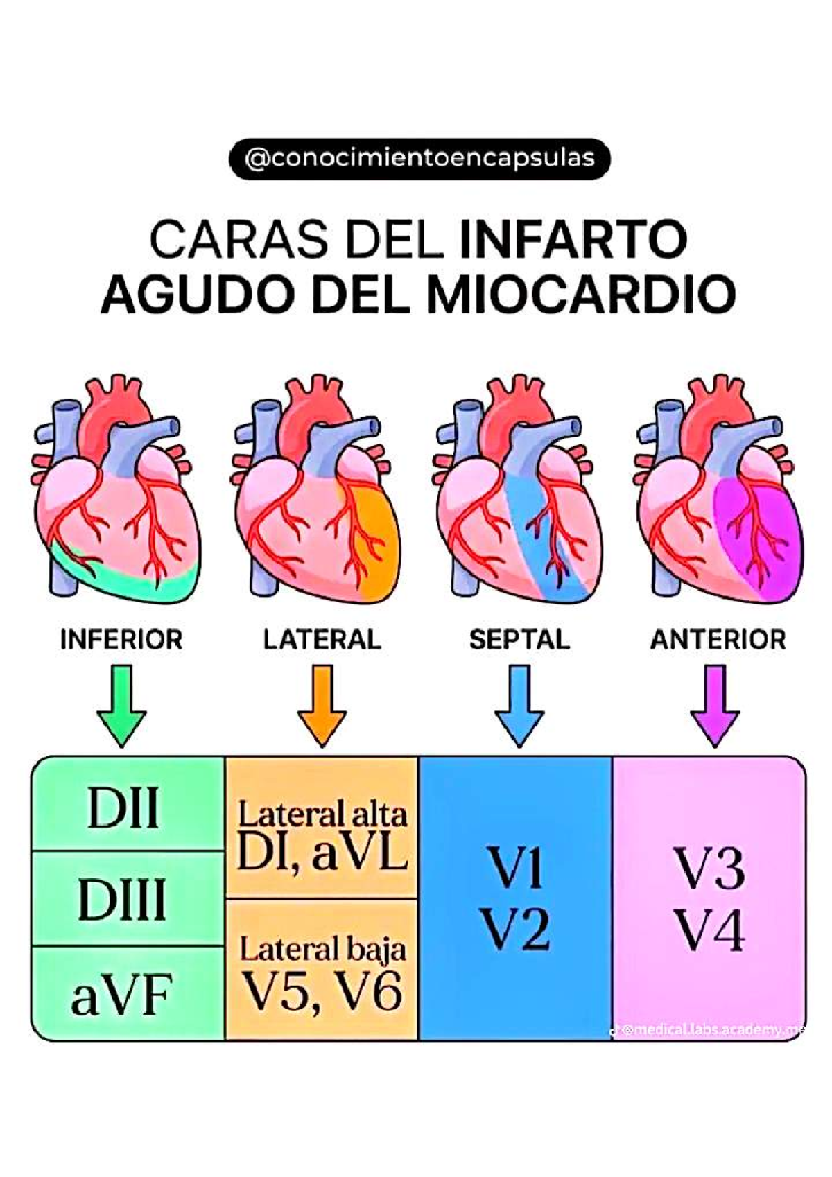 Guía de Cardiología: Infarto Agudo y Ritmos de Paro Cardíaco - Studocu