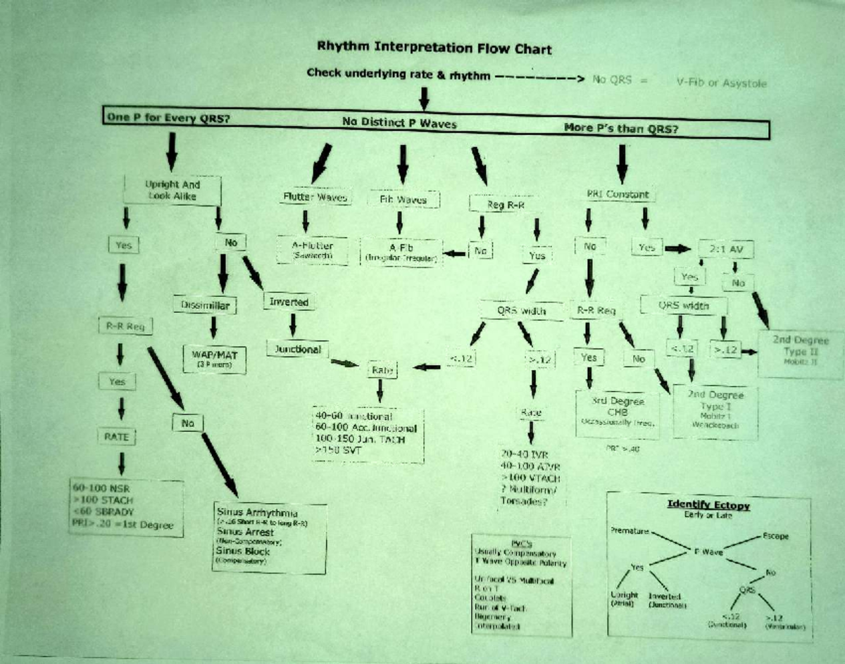 Rhythm Flow Chart for Cardiac Interpretation: A Comprehensive Guide ...