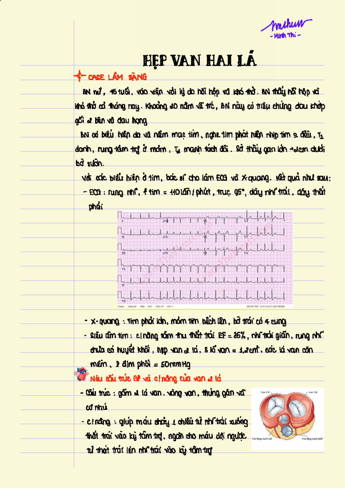 Hẹp Van 2 Lá - Case Study BN 45 Tuổi: Chẩn Đoán và Điều Trị - Studocu