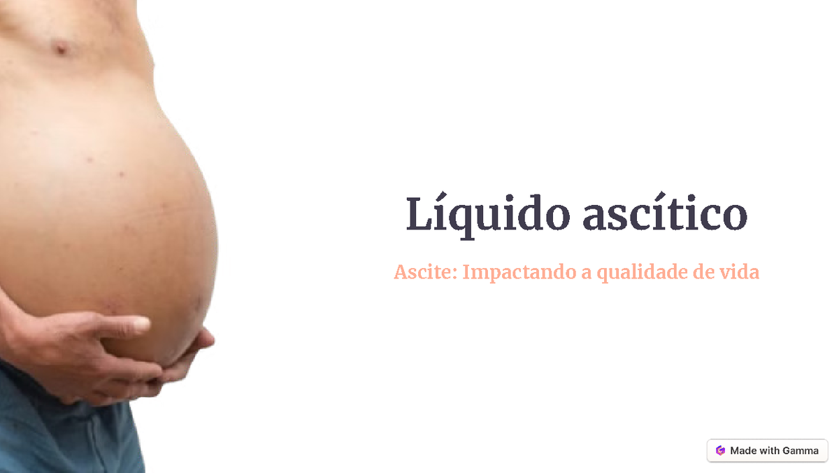Liquido-ascitico-slide - Líquido ascítico Ascite: Impactando a ...