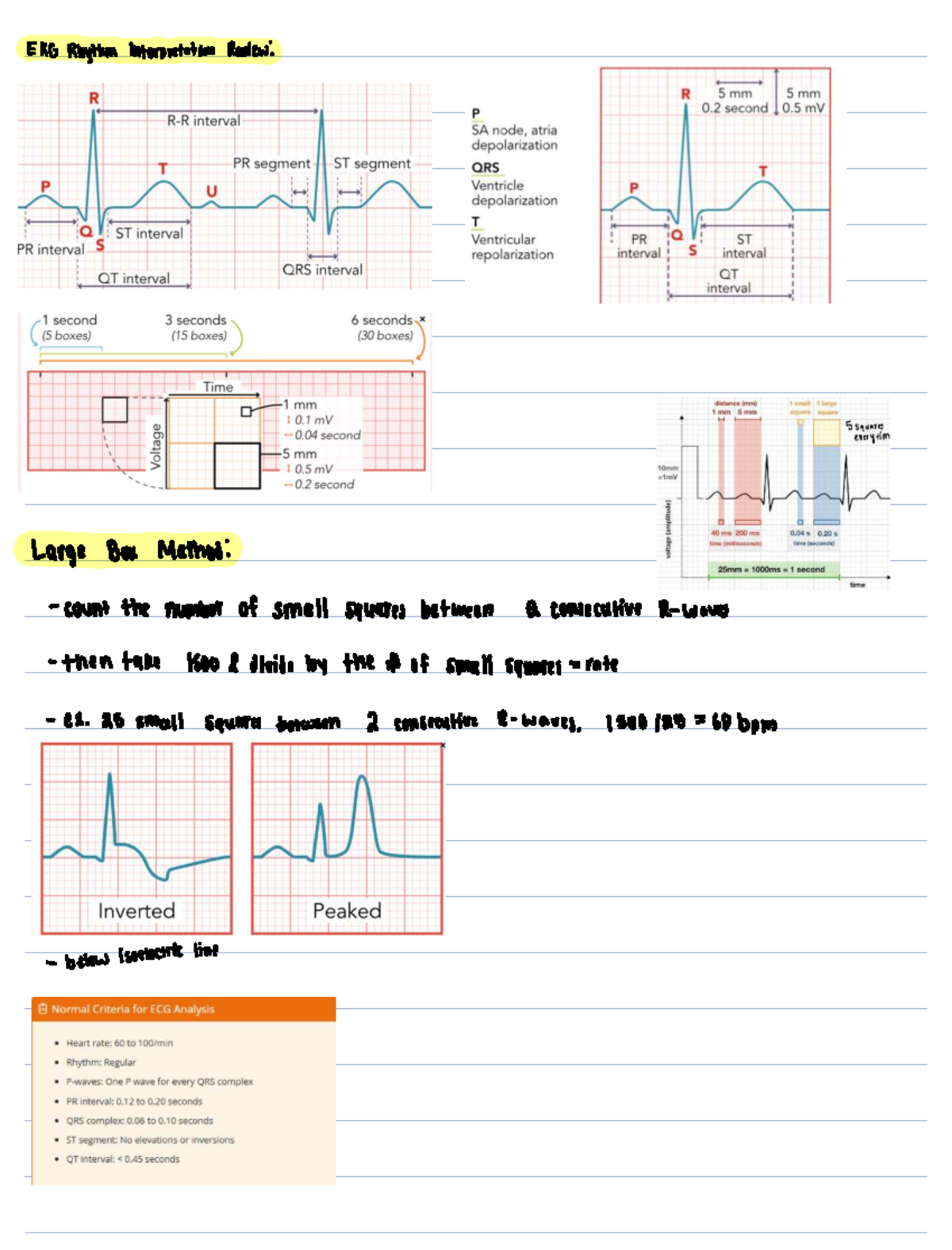 EKG Rhythm Interpretation Review: Key Concepts & Nursing Care - Studocu