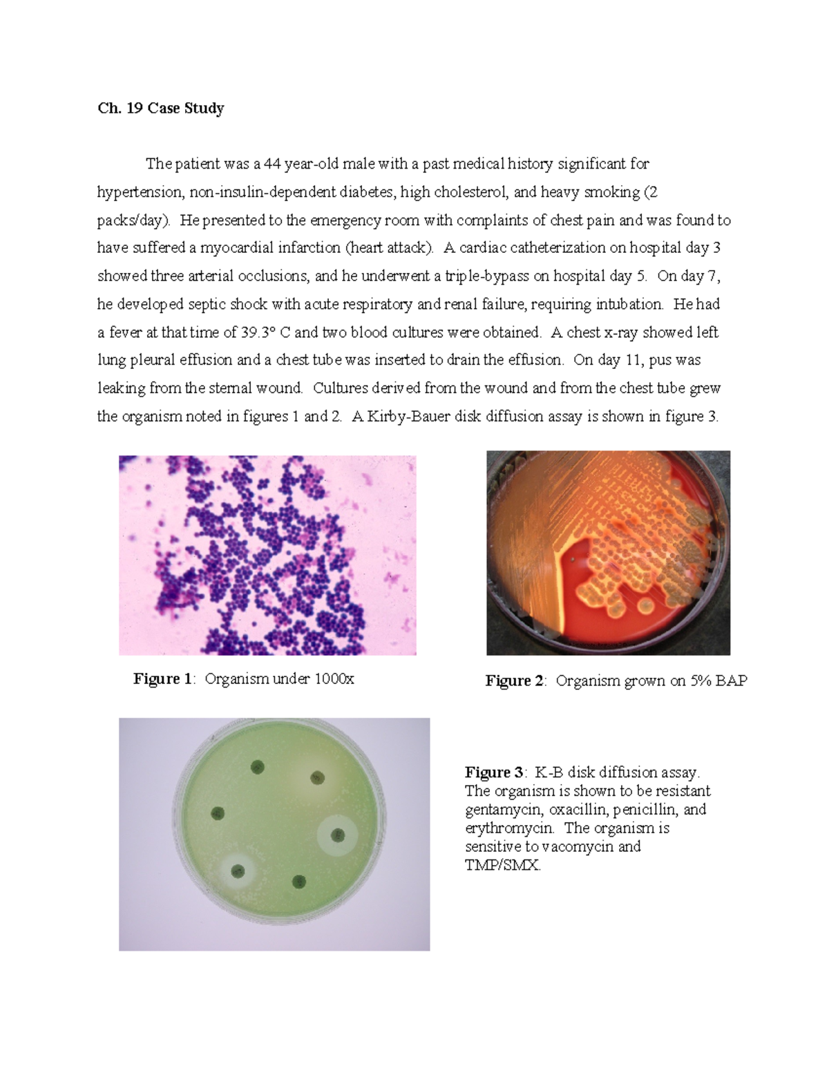 Ch. 19 HW-1 - Case Study on MRSA Infection and Management Strategies ...