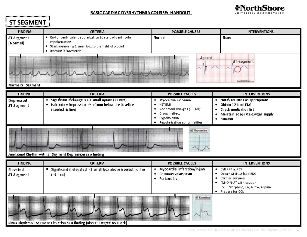 BASIC CARDIAC DYSRHYTHMIA COURSE: EKG STUDY MATERIALS HANDOUT - Studocu