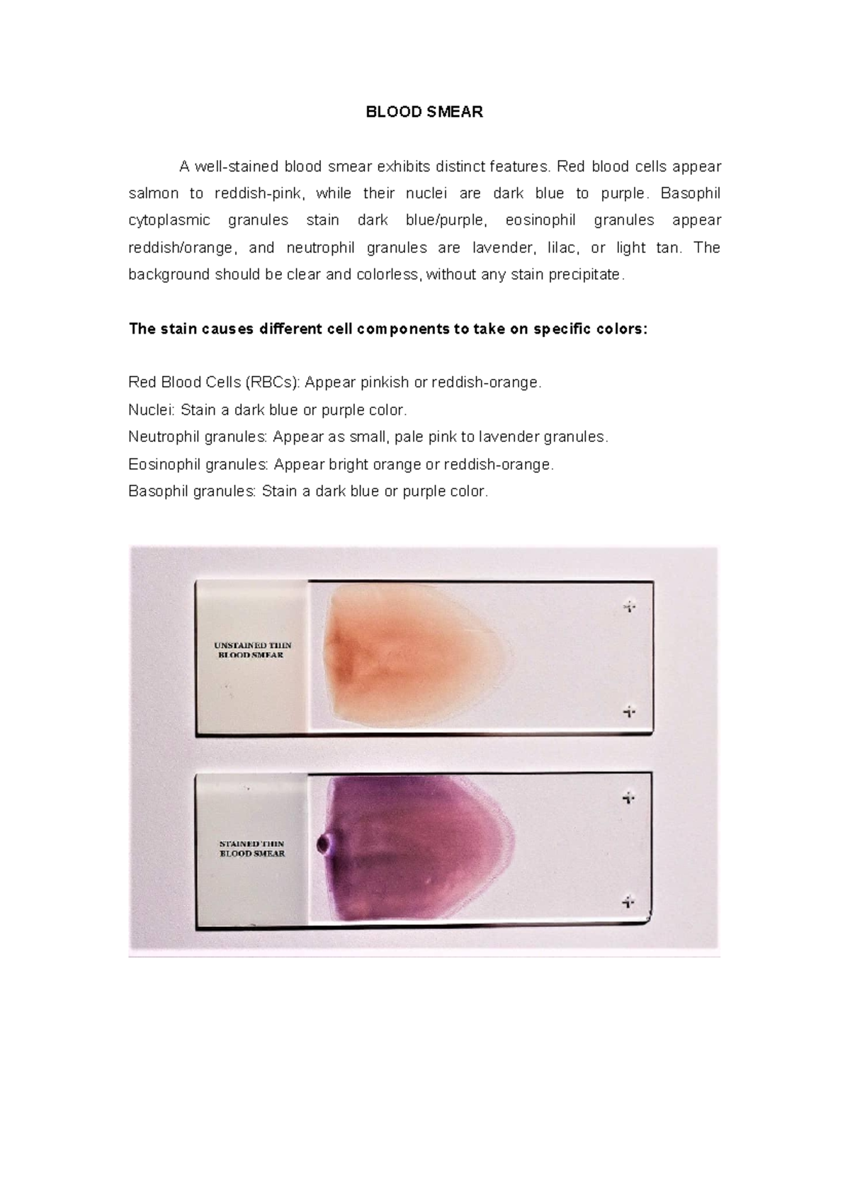 Blood smear analysis: Distinct features of blood cell staining - Studocu