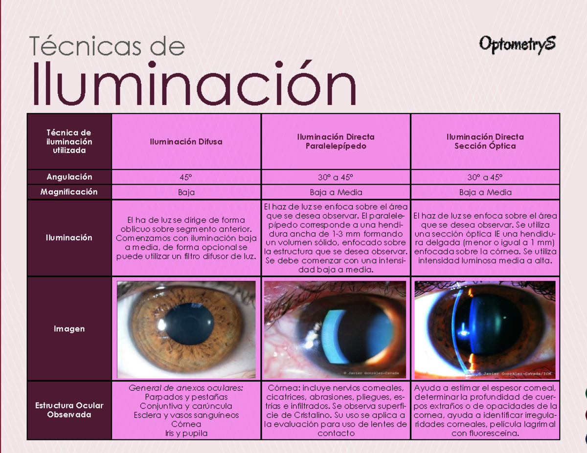 Técnicas de Iluminación en Optometría: Métodos y Aplicaciones - Studocu