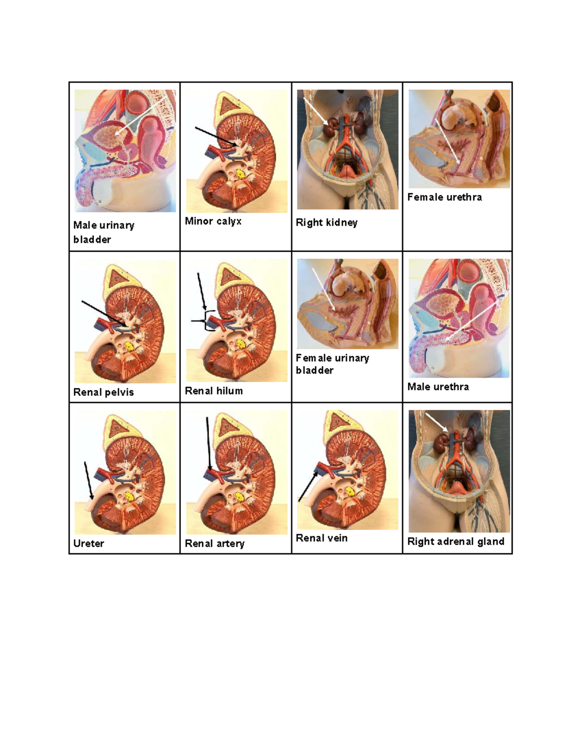 Lab Study Guide Urinary - Google Docs - Male urinary bladder Minor ...