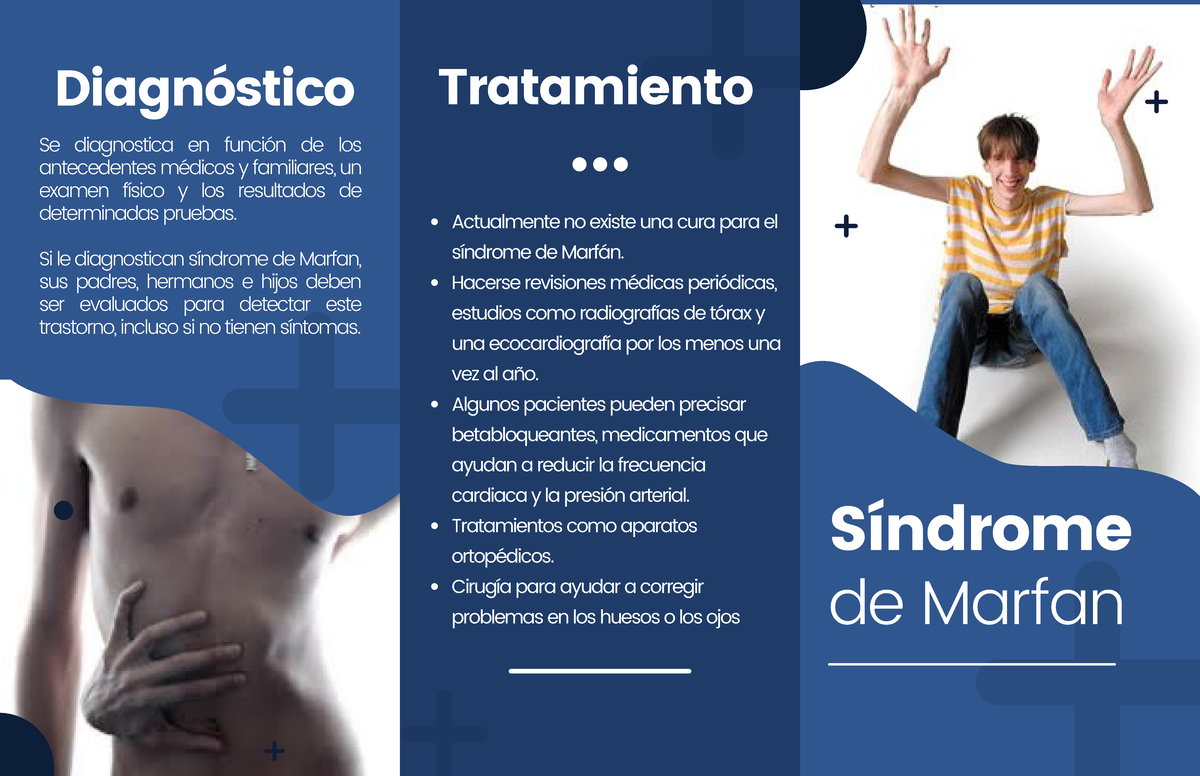Síndrome de Marfan Folleto - Actualmente no existe una cura para el síndrome de Marfán. Hacerse ...