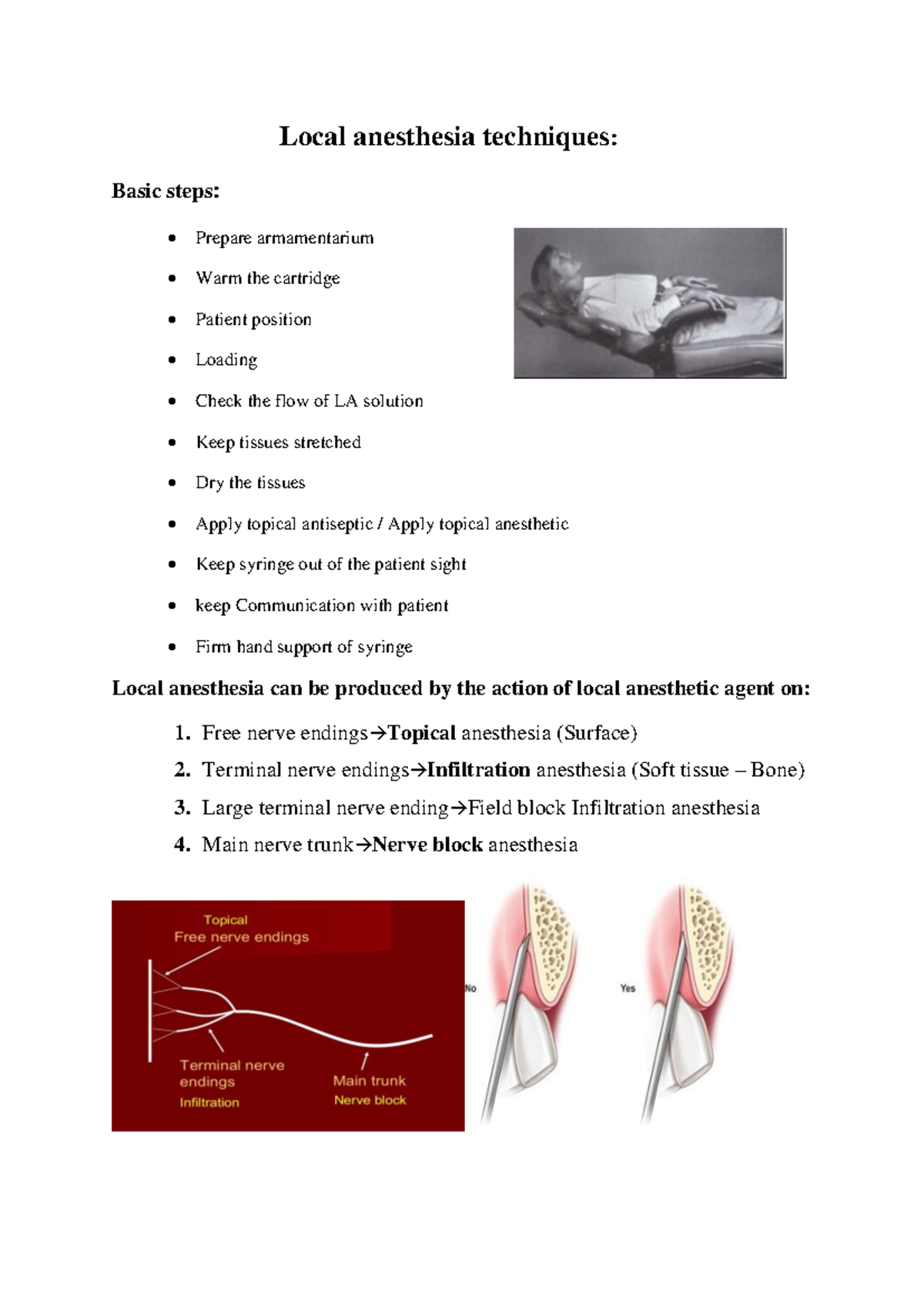 Local Anesthesia Techniques in Dentistry (DENT 101) - Comprehensive ...
