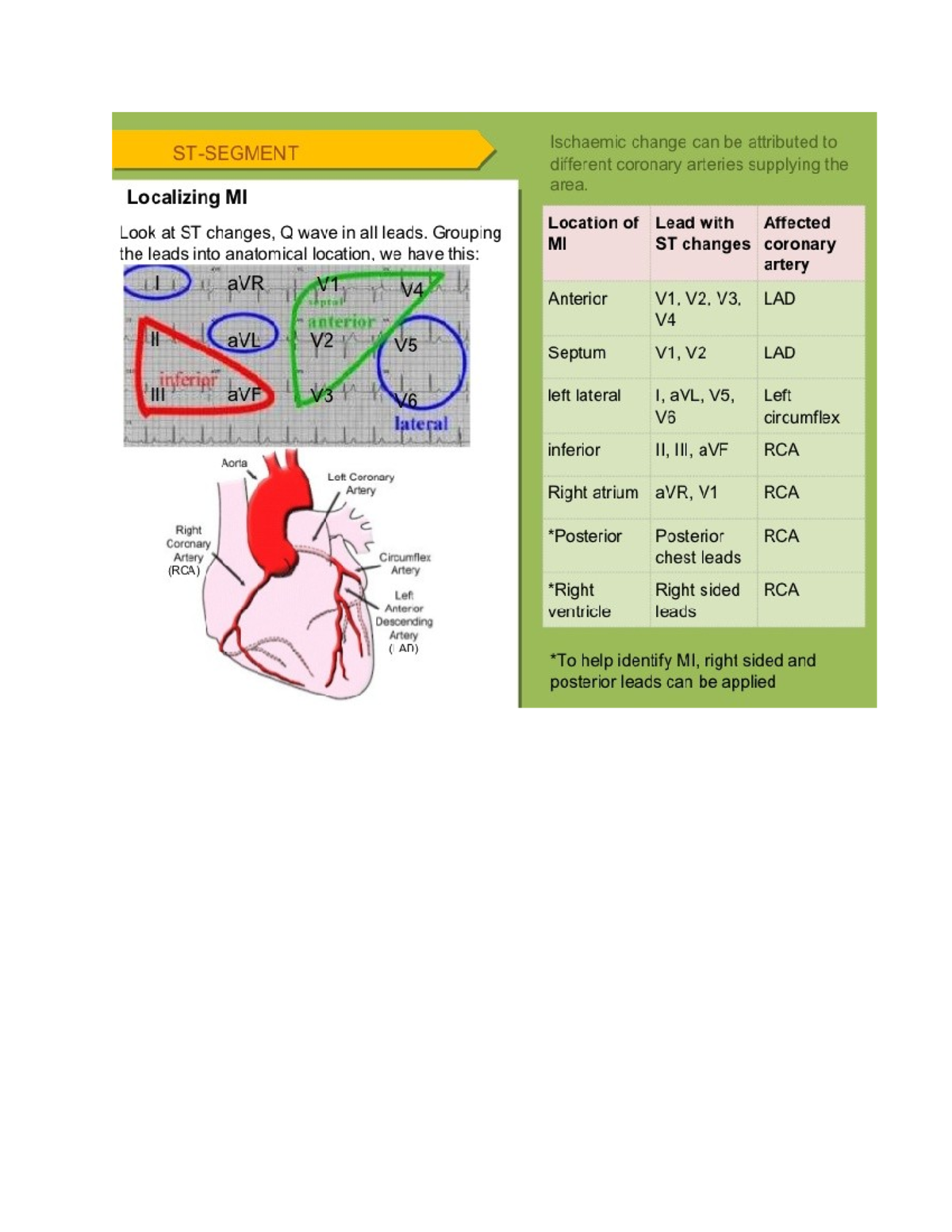12 Lead EKG Cheat Sheet: MI Localization & Ischemic Changes - Studocu