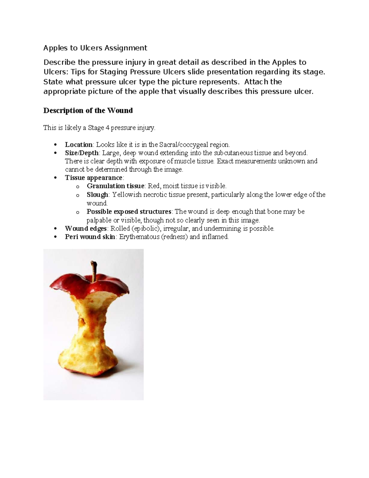 Apples to Ulcers Assignment: Detailed Analysis of Stage 4 Pressure ...