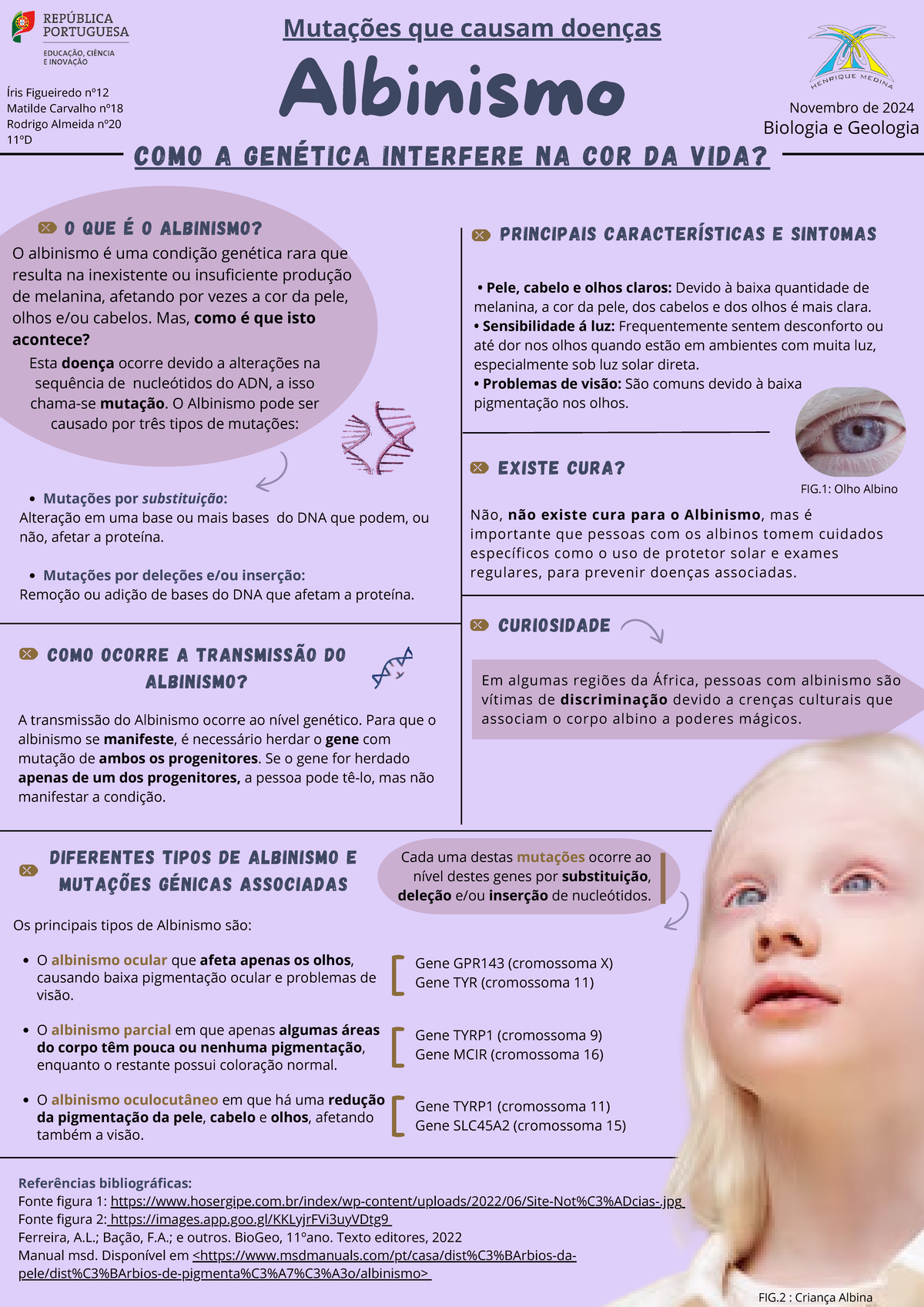 Oficial - Albinismo. - ####### Os principais tipos de Albinismo são ...