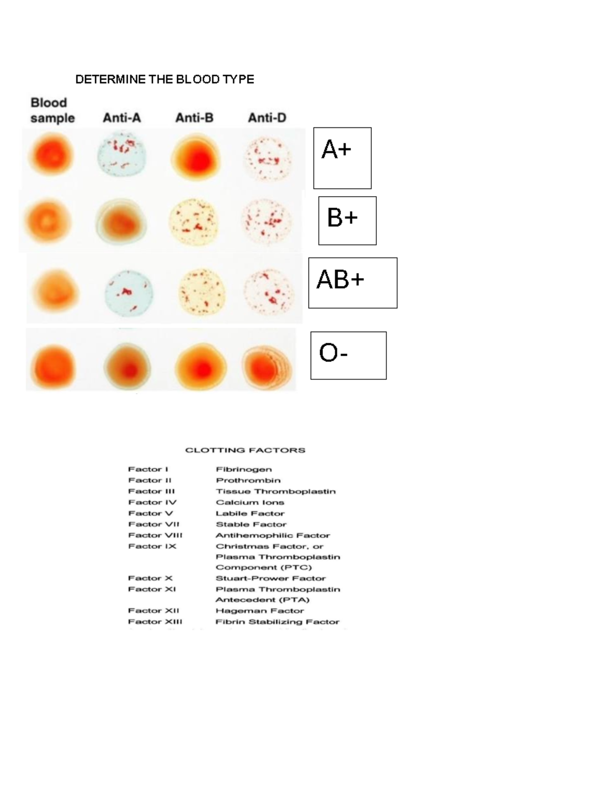 USSHS 2023 Final Exam Reviewer: Blood Type Identification & Lab ...