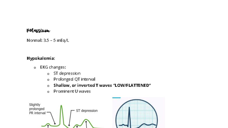 EKG Changes in Electrolyte Imbalances: Hypo/Hyperkalemia & Magnesium ...