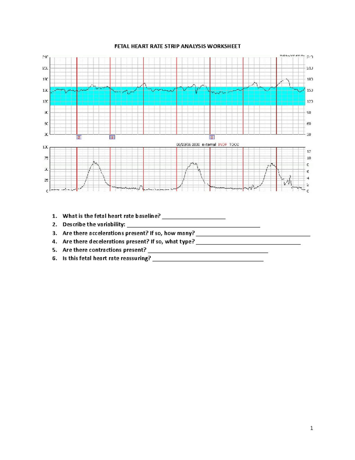 Fetal Heart Rate Strip Analysis Guide for Clinical Practice - Studocu
