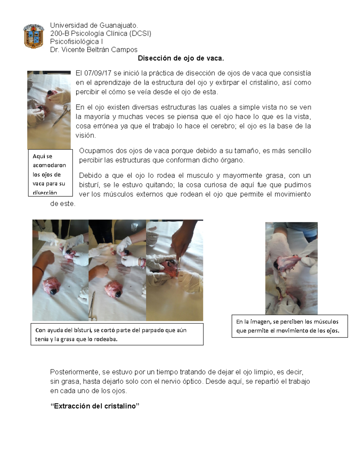 Hoja De Trabajo De Disección Del Ojo 1 UNIVERSIDAD AUTÓNOMA