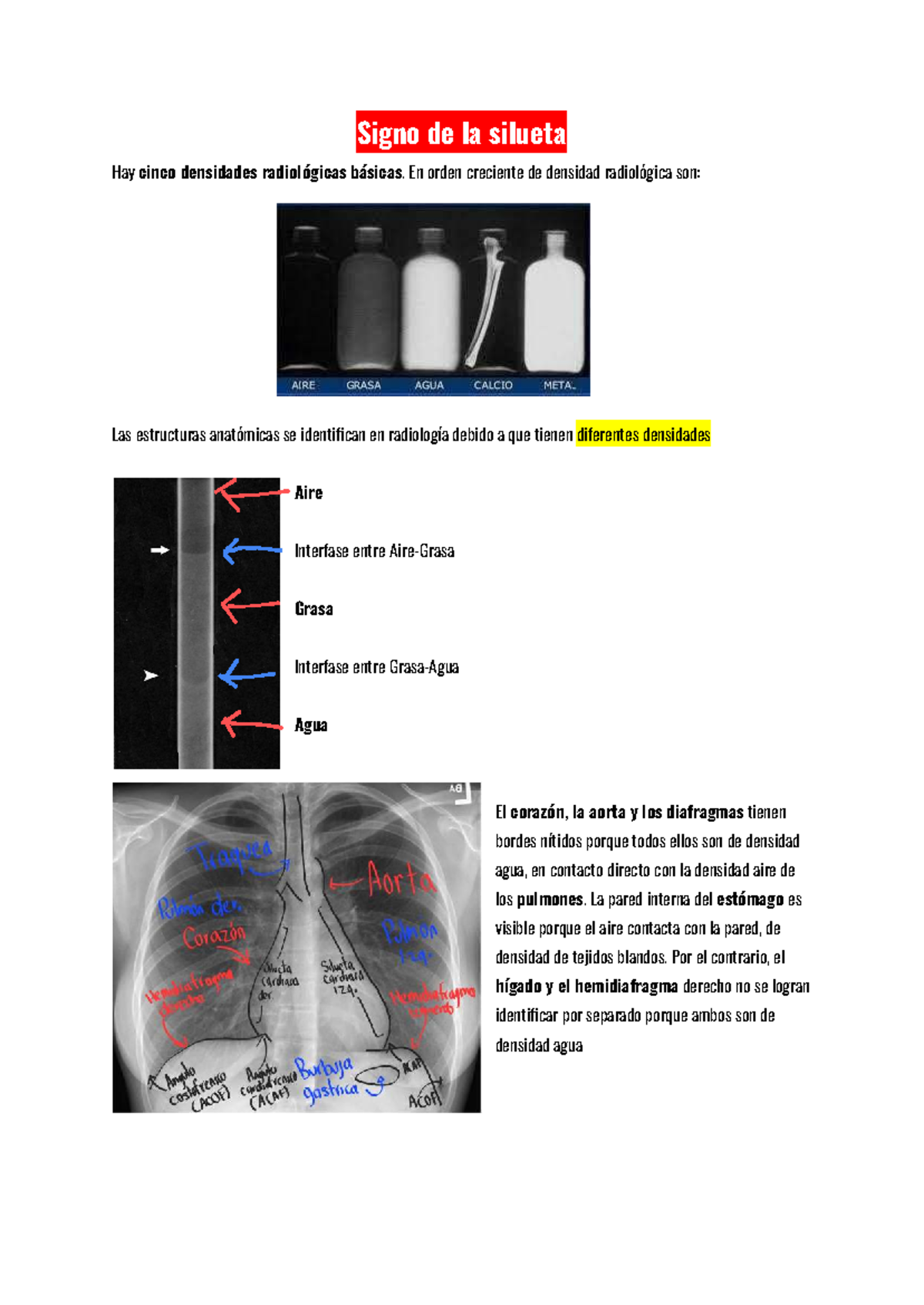 Signos Radiológicos en Tórax: Densidades y Signo de la Silueta - Studocu