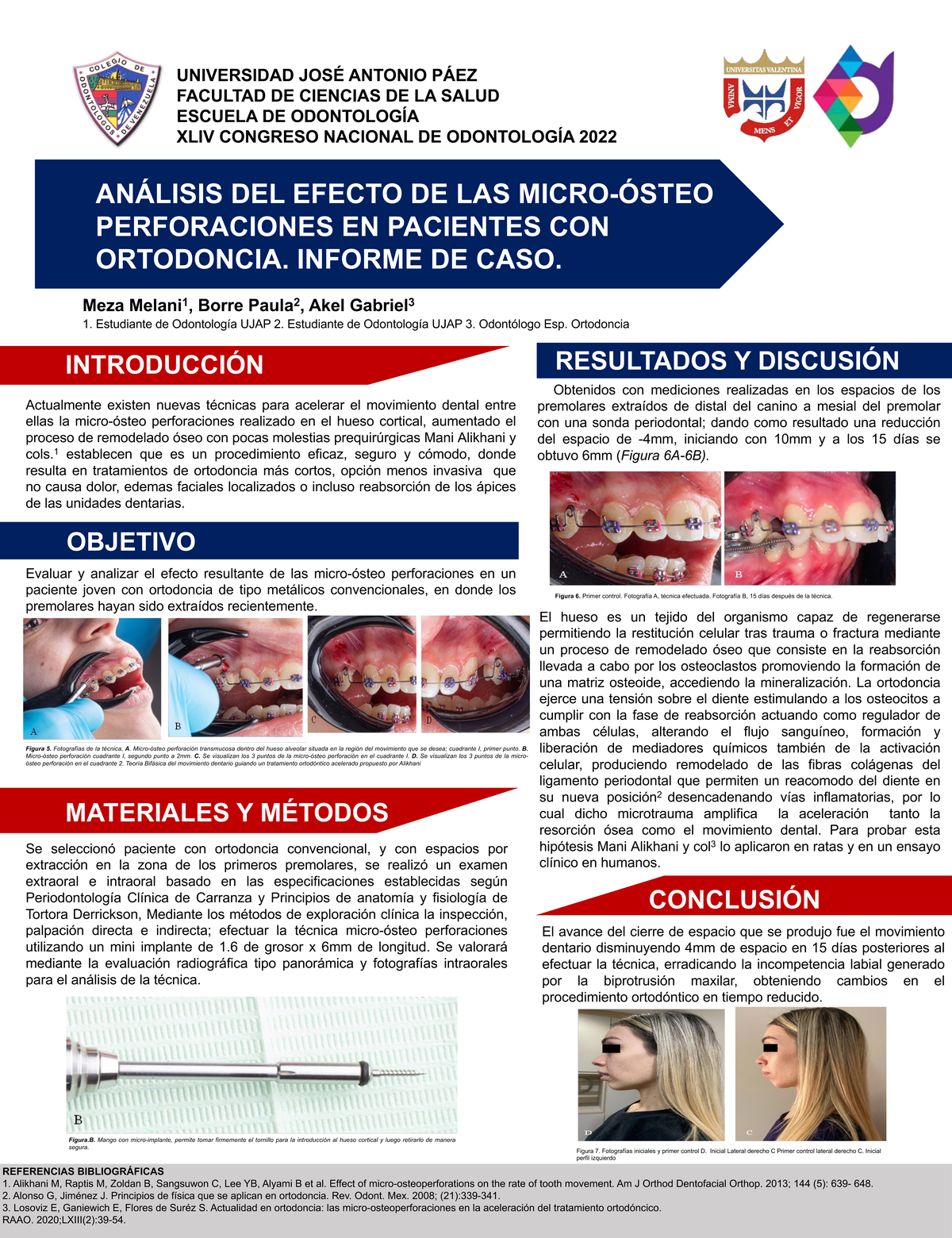 Informe de Caso: Efecto de Micro-Ósteo Perforaciones en Ortodoncia ...
