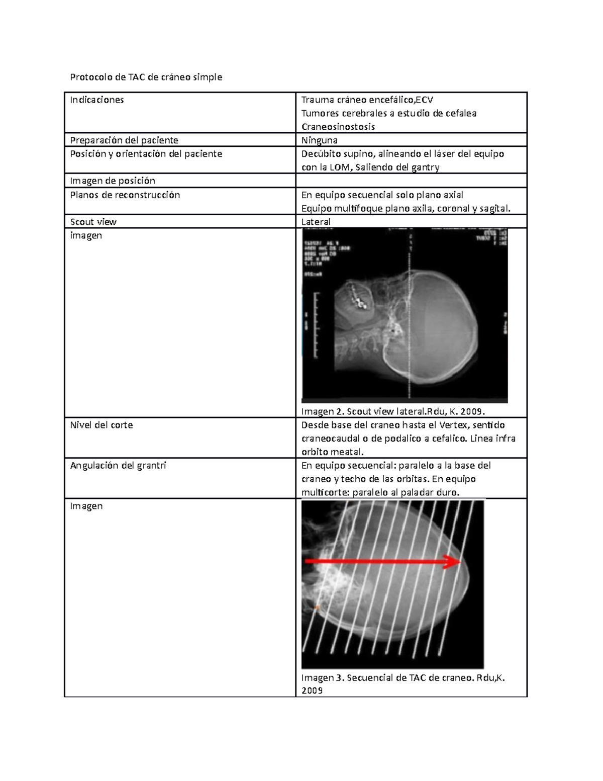Protocolos de tomografia - Protocolo de TAC de cráneo simple Indicaciones Trauma cráneo - Studocu