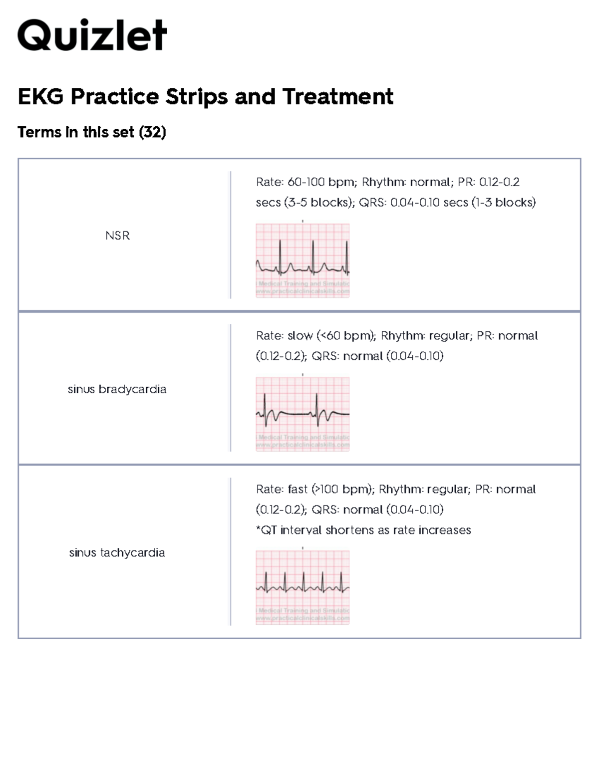 EKG Strips & Treatment Flashcards Quizlet for Exam Prep - Studocu