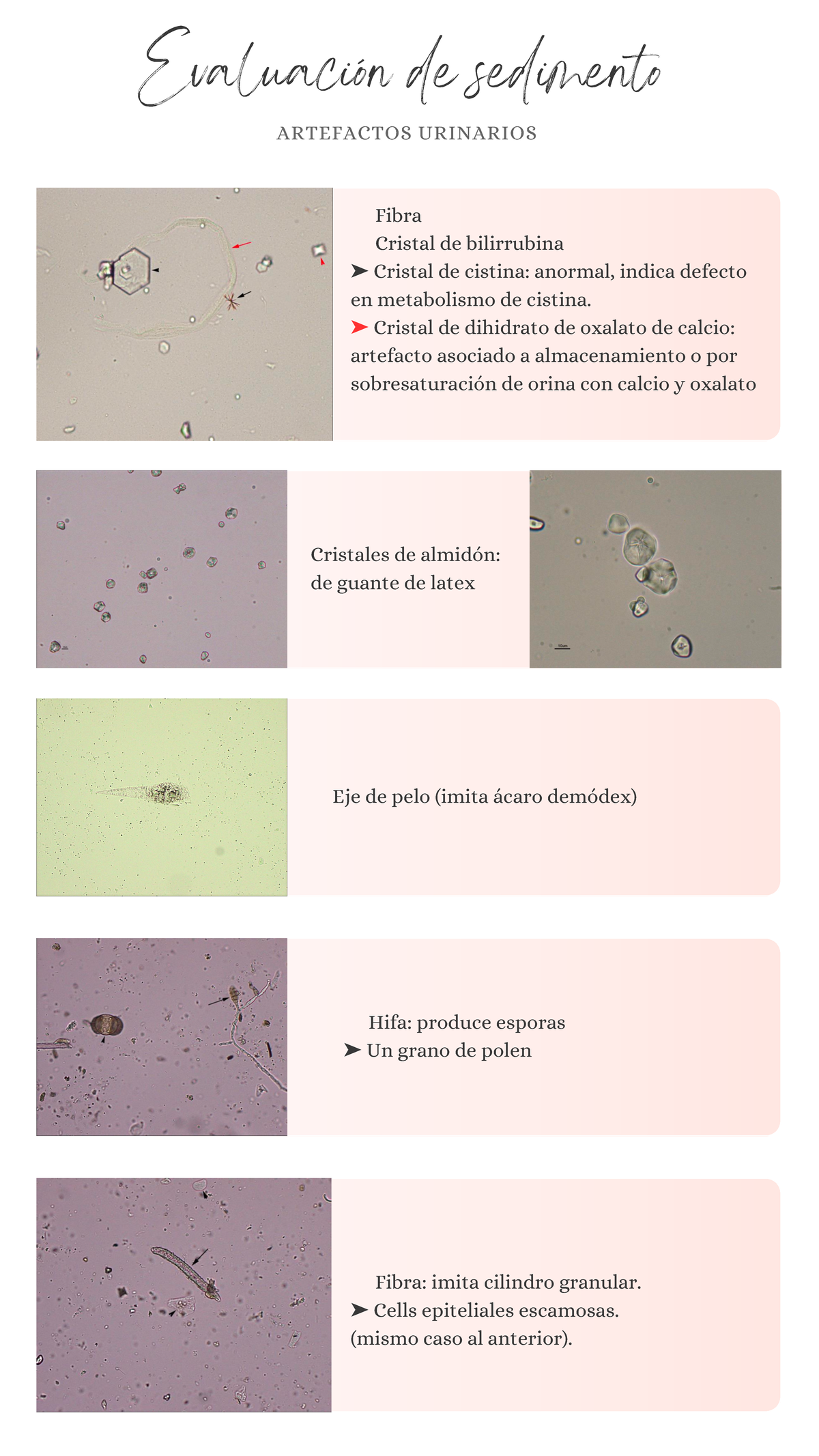 Evaluación de sedimento: artefactos urinarios (Camila Arqueros) - Hifa: produce esporas Un grano ...
