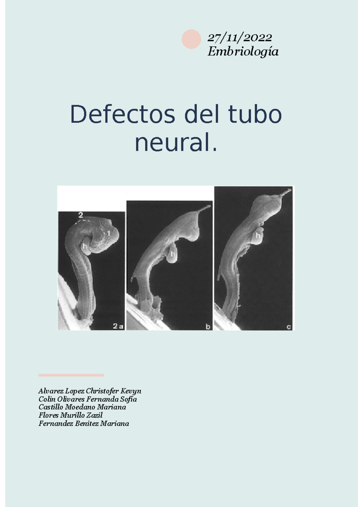Tubo Neural - 27/11/ Embriología Defectos del tubo neural. Alvarez ...
