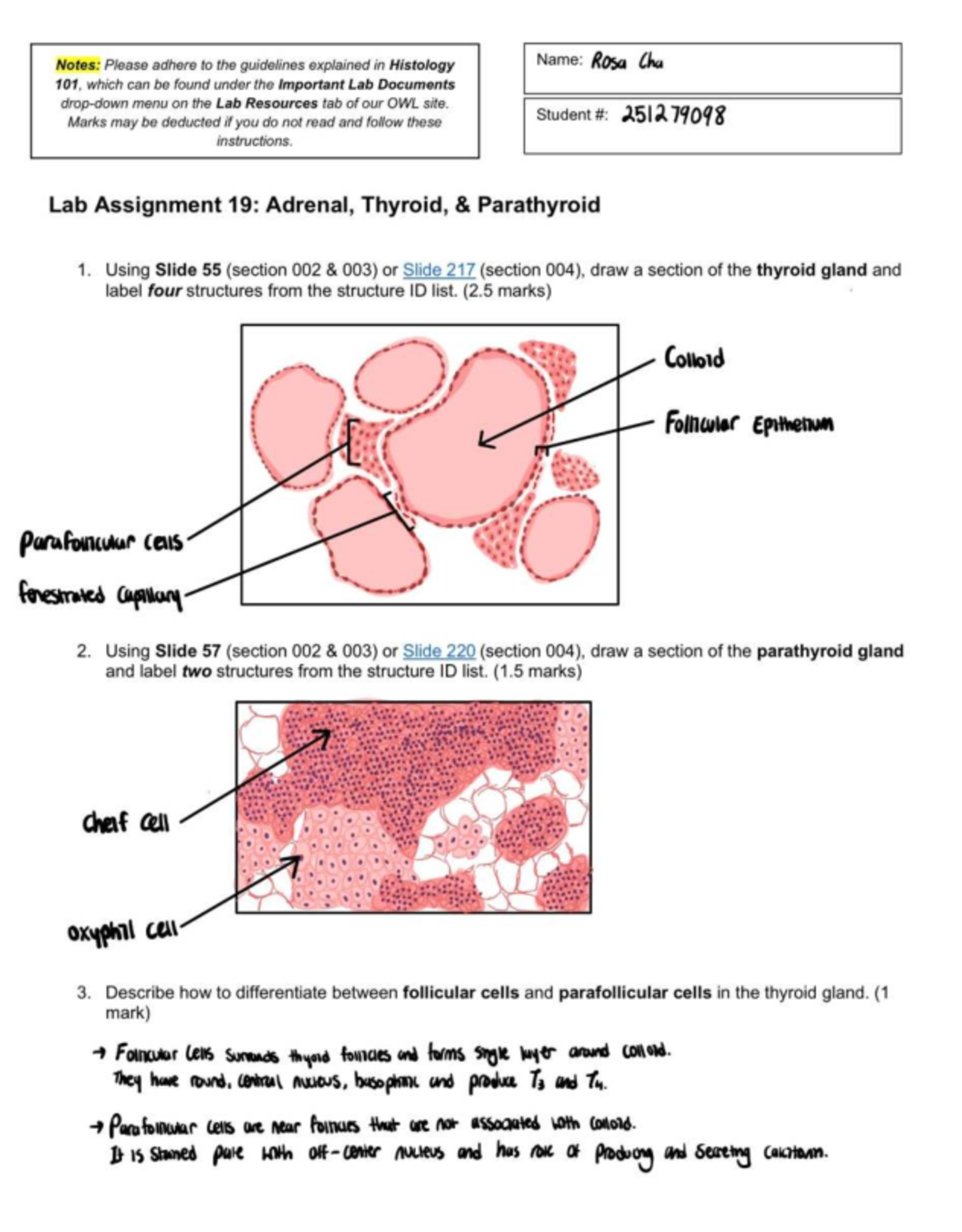 Parathyroid Gland Histology Labeled Diagram