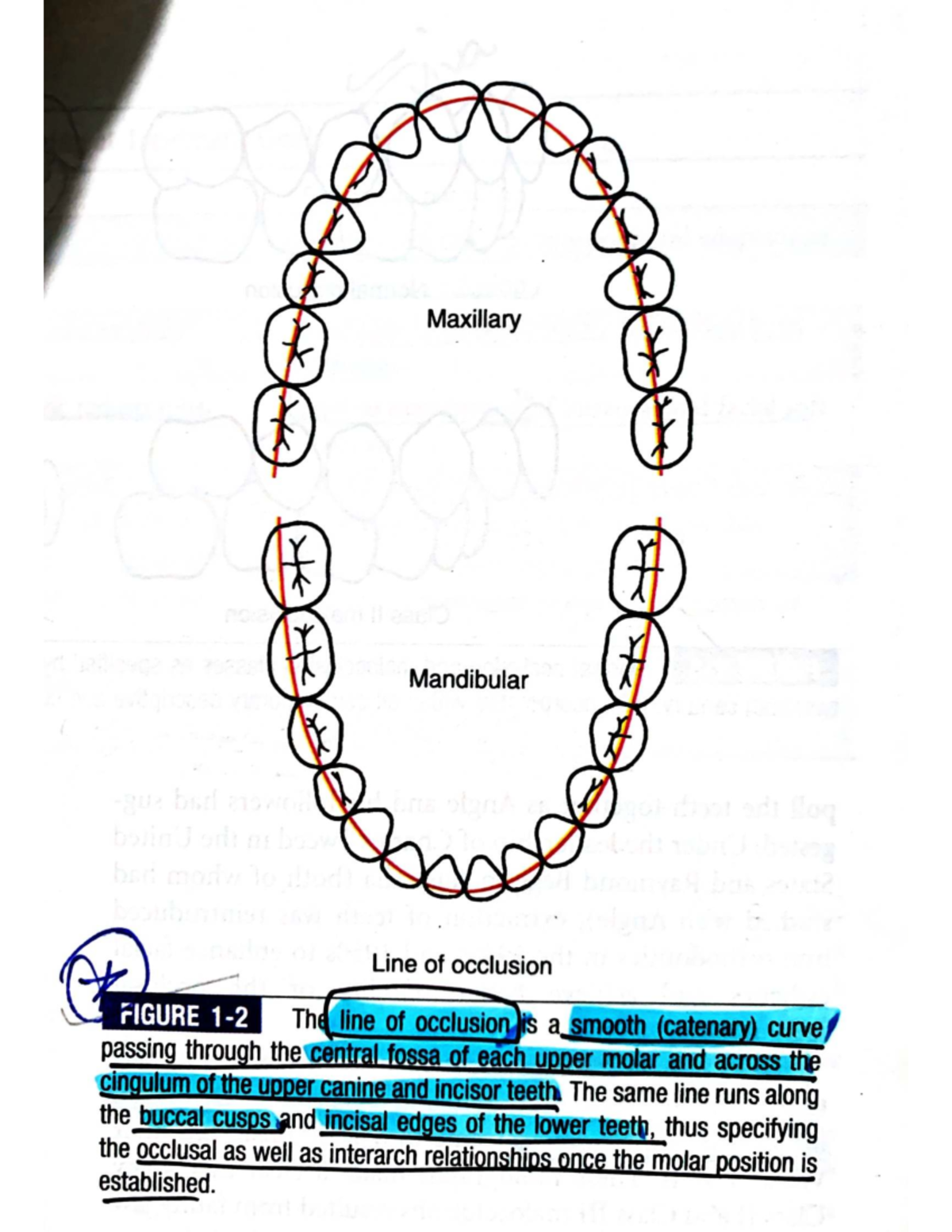 Chapter 01 - Maxillary Mandibular Line of Occlusion & Malocclusion ...