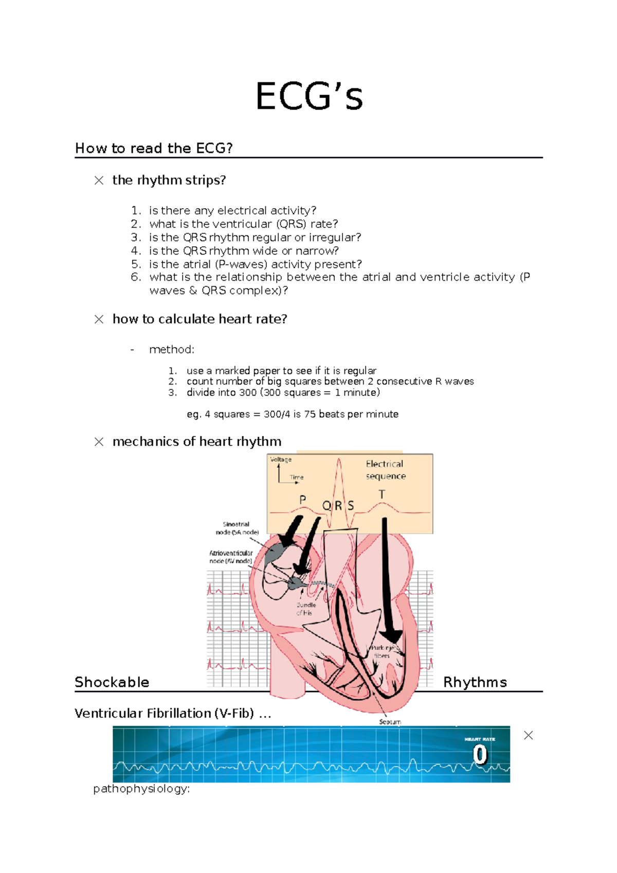ECG - How to read a rhythm strip, how to calculate heart rate ...