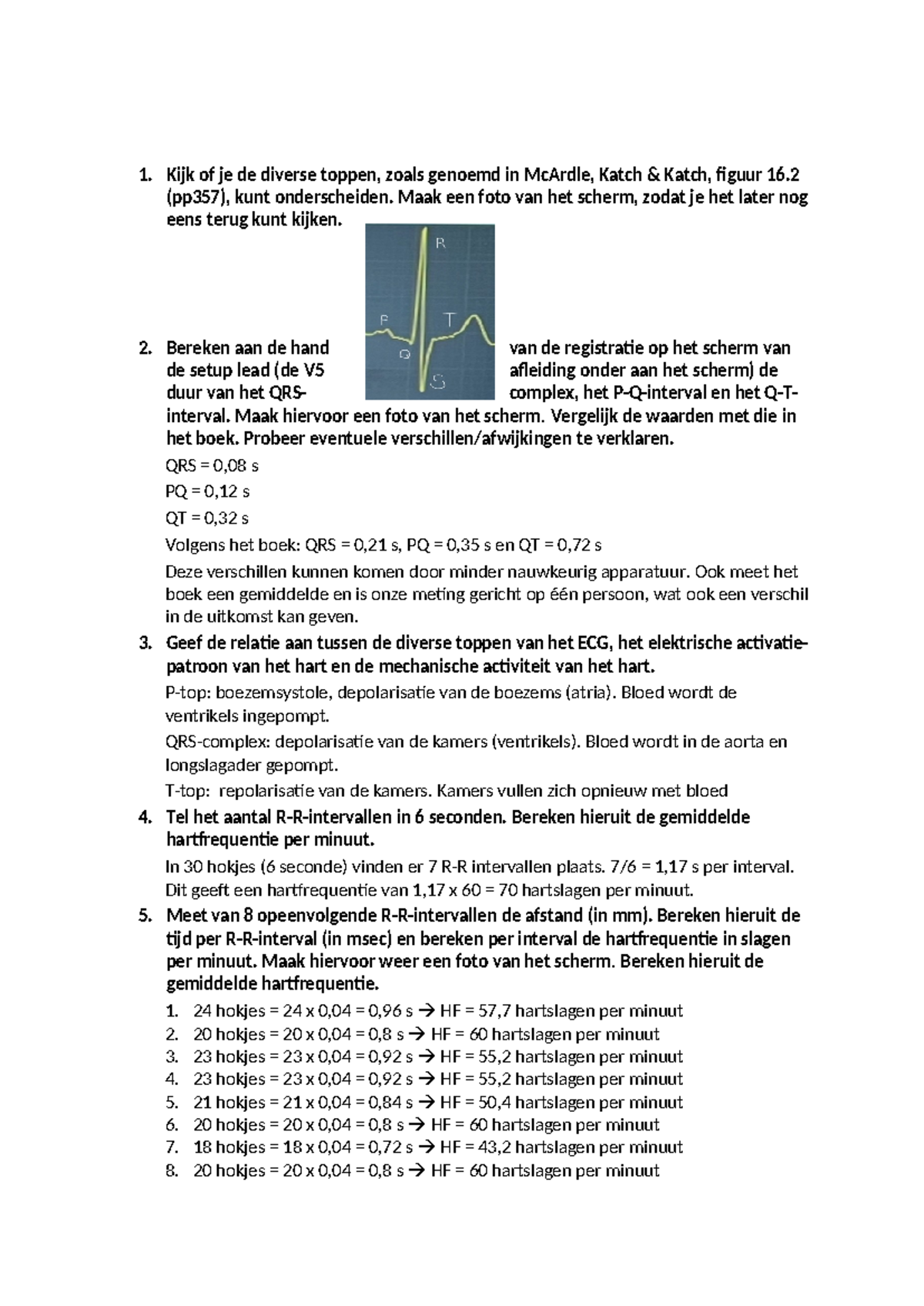 Practicum 3 IF 2025: ECG Analyse en Hartfrequentie Berekeningen ...