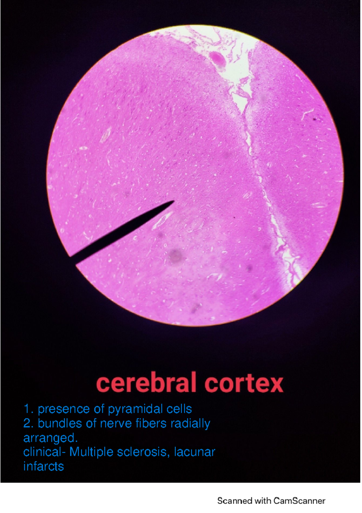 Anatomy Histo Notes: Pyramidal Cells, Nerve Fibers & Pathologies - Studocu