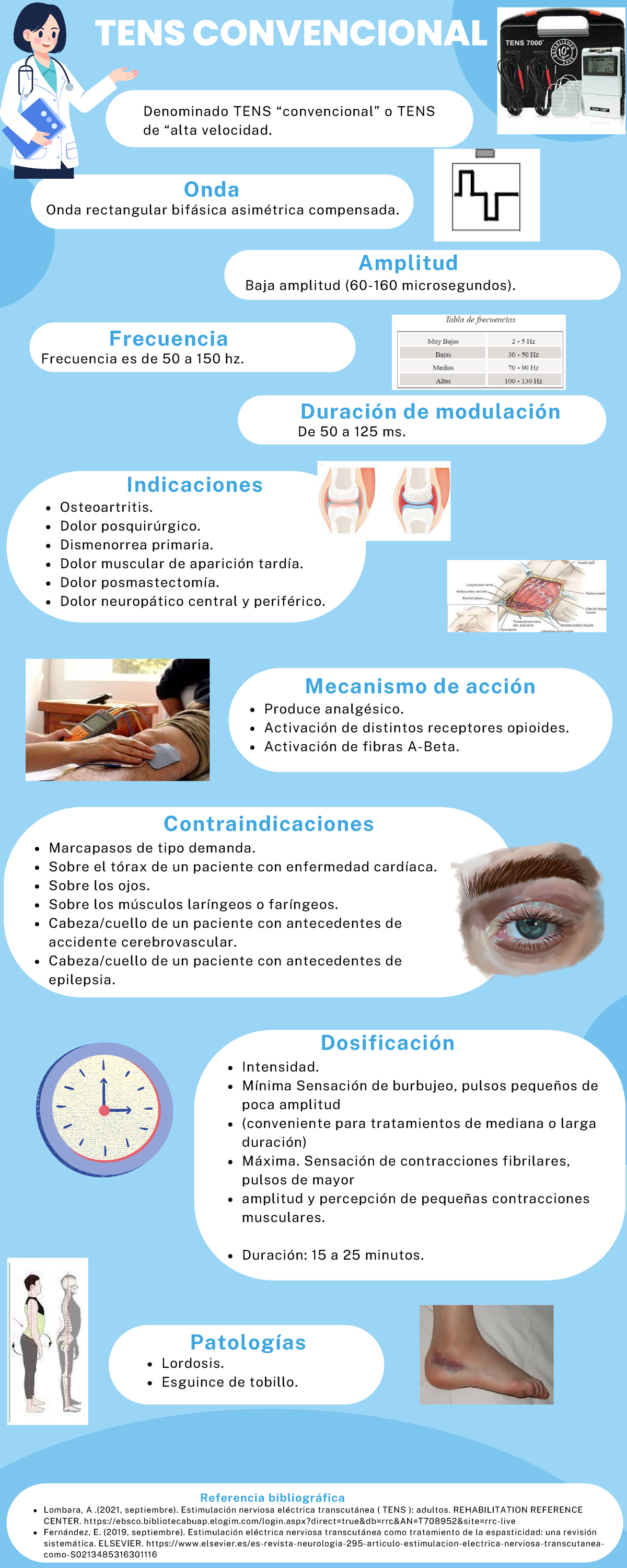 Infografìa DE TENS Convencional - Marcapasos de tipo demanda. Sobre el ...