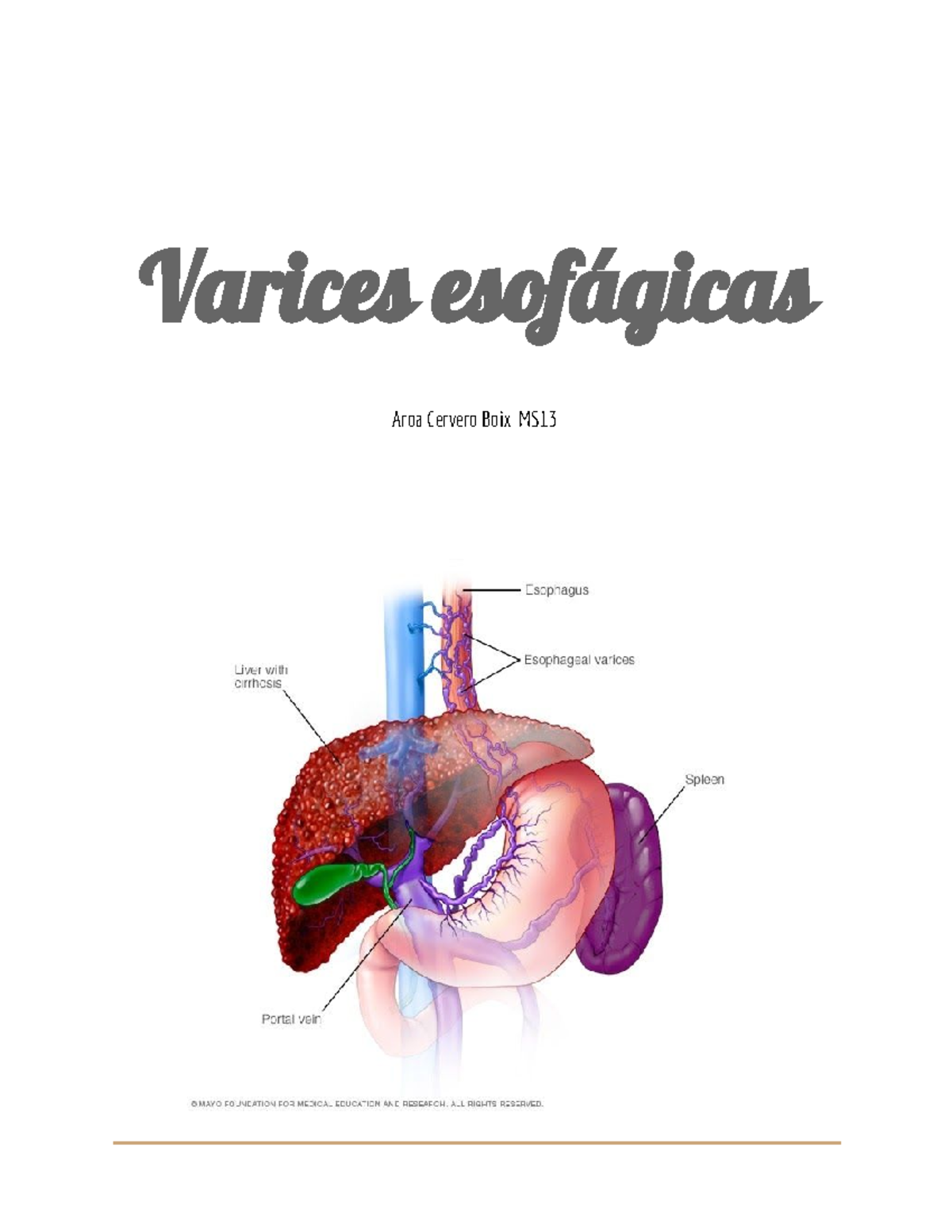 Anatomía De Las Varices Esofágicas
