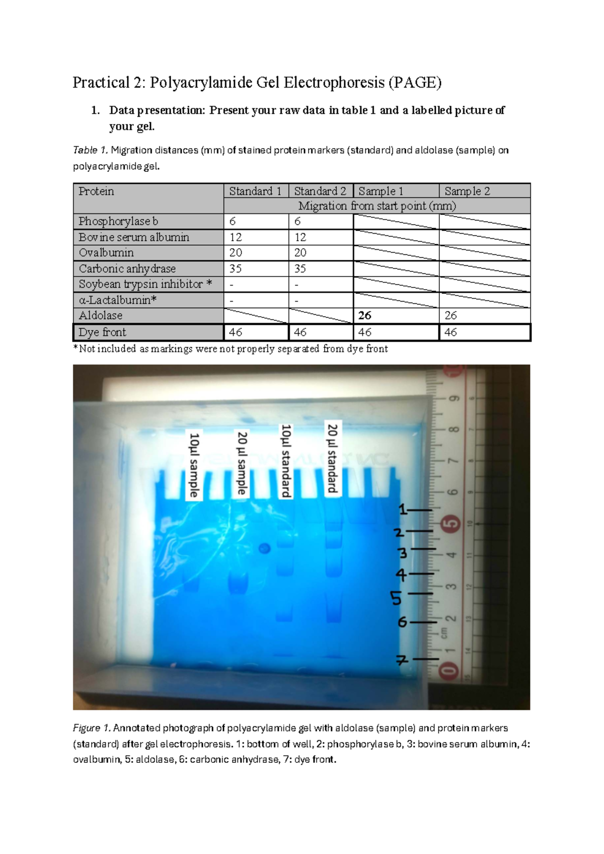 BIOL2171 Practical 2: Polyacrylamide Gel Electrophoresis Analysis - Studocu