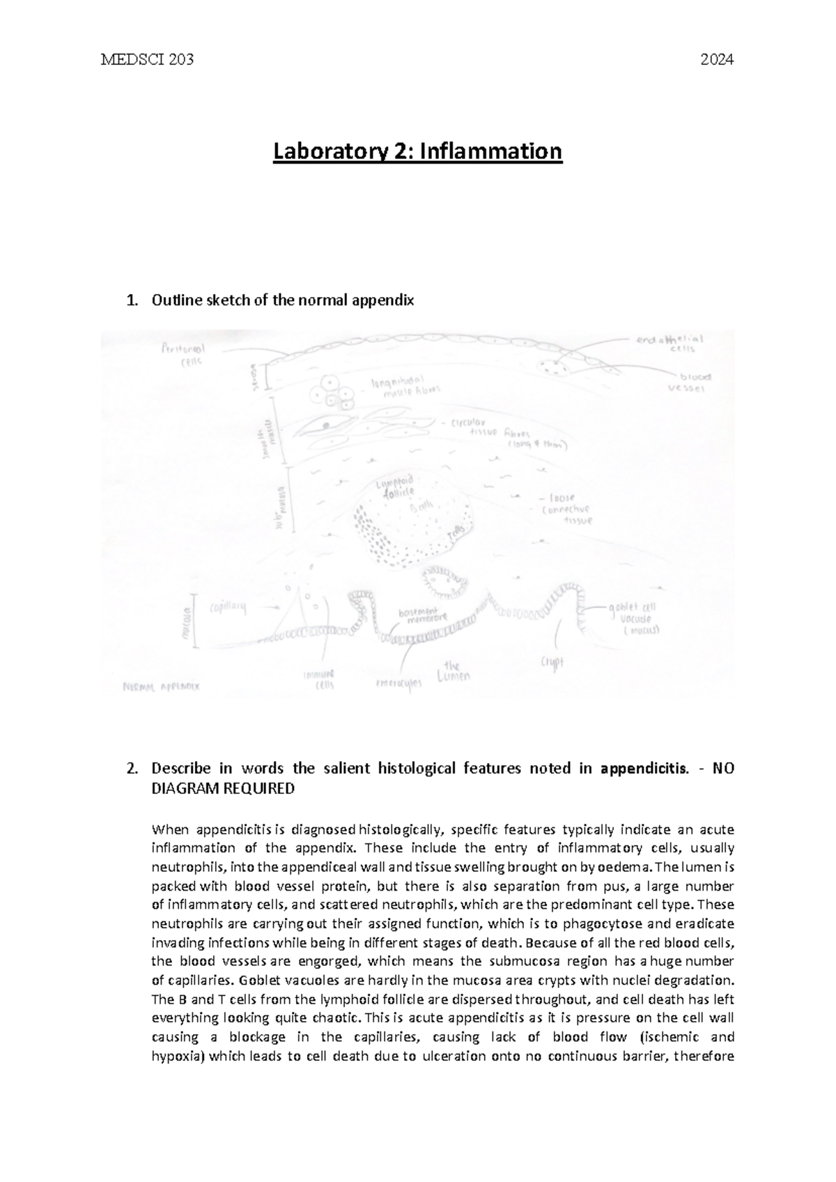 Medsci 203 Lab 2 Report - MEDSCI 203 2024 Laboratory 2 : Inflammation Name Diya Gounder ID ...