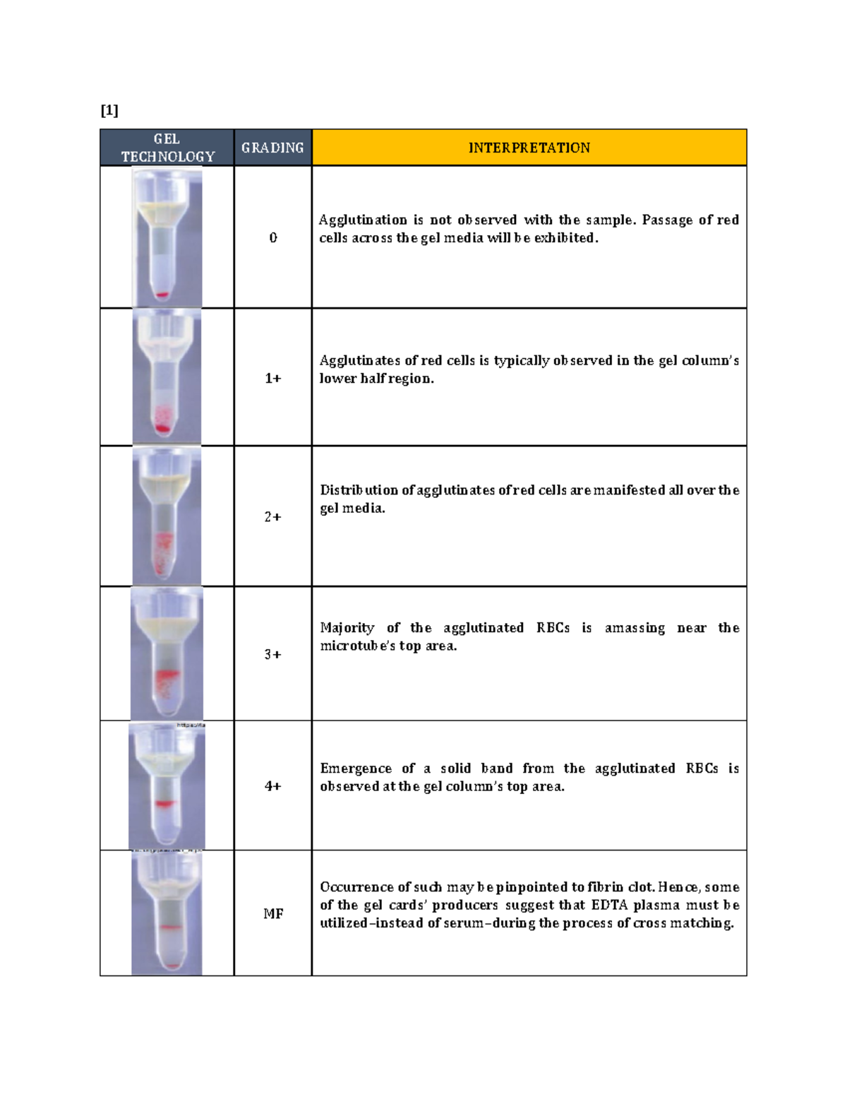 Upload 2 - Lecture note - [1] GEL TECHNOLOGY GRADING INTERPRETATION 0 ...