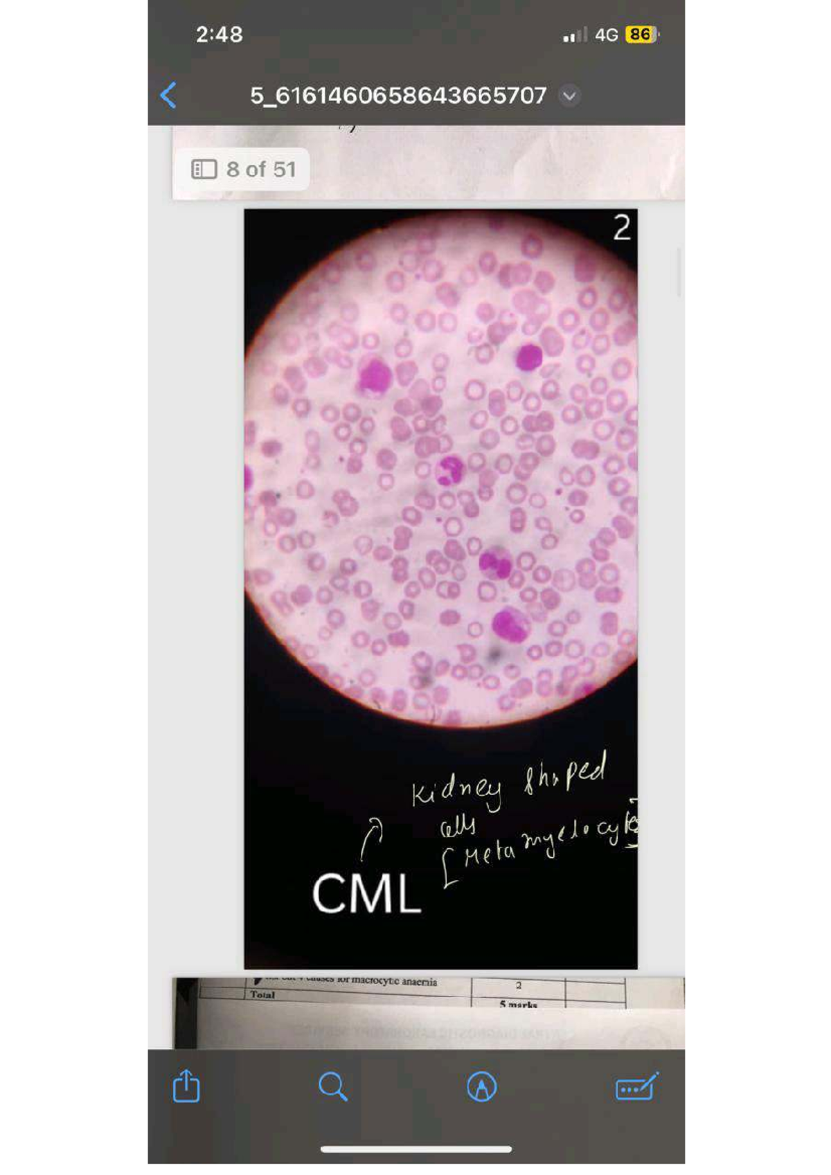 1st Internal Pathology Exam Notes: Haematology PA14.3 & PA15.3 - Studocu