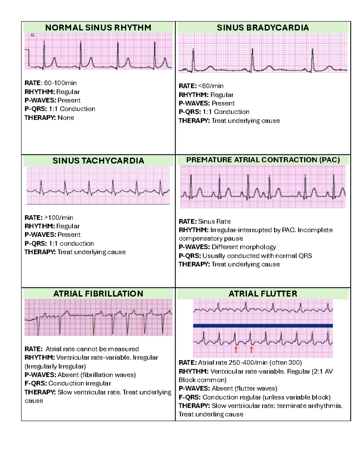 ECG - yes - NORMAL SINUS RHYTHM RATE: 60-100min RHYTHM: Regular P-WAVES ...