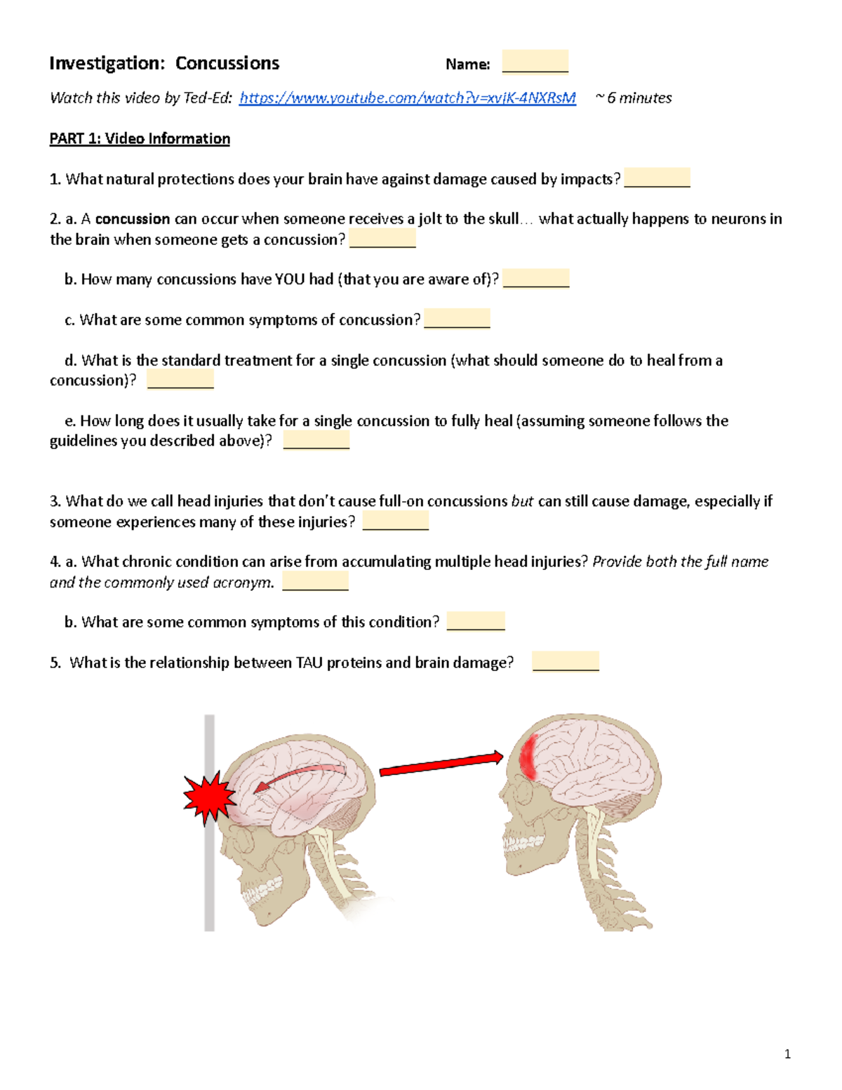 Investigation of Concussions and Their Impact: Key Insights and ...