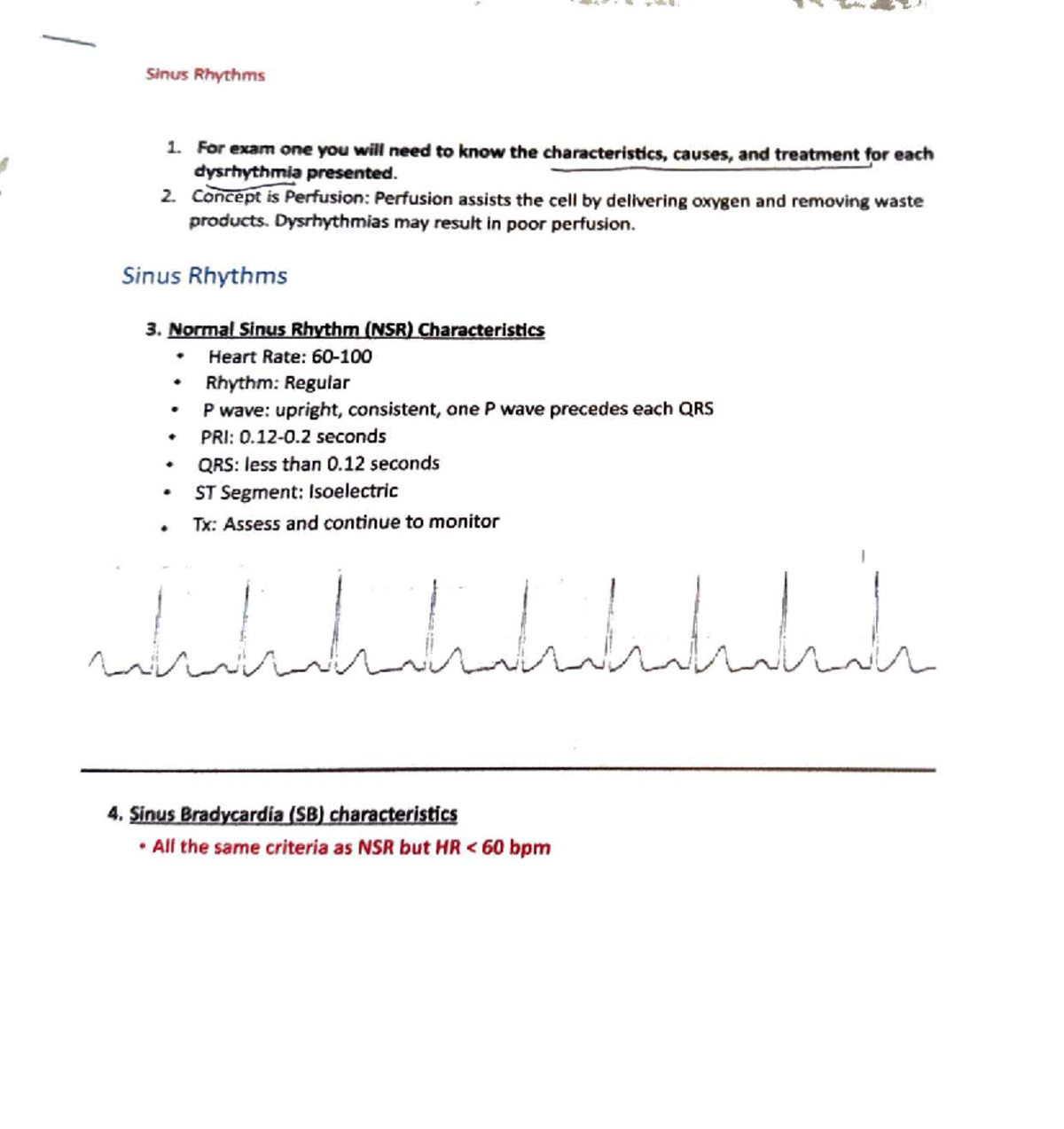 Sinus Rhythms Overview: Characteristics, Causes, and Treatments for ...